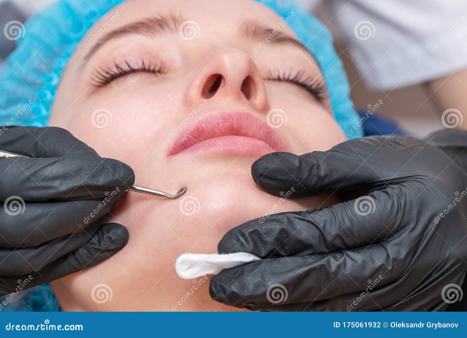 Mechanical Cleaning of the Face with Extractor Stock Photo - Image of ...