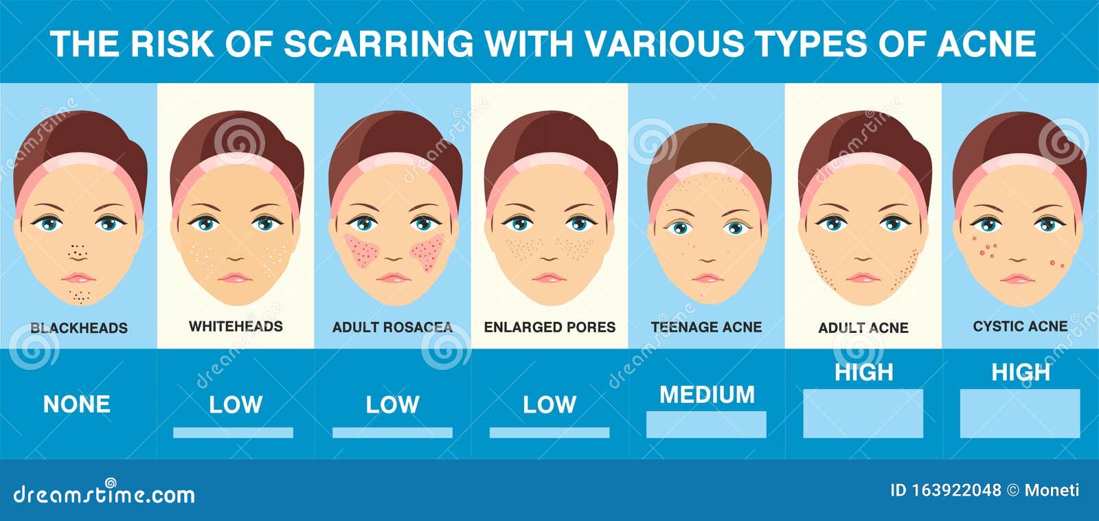 Acne Scars Different Types Of Acne Infographics Stock Vector