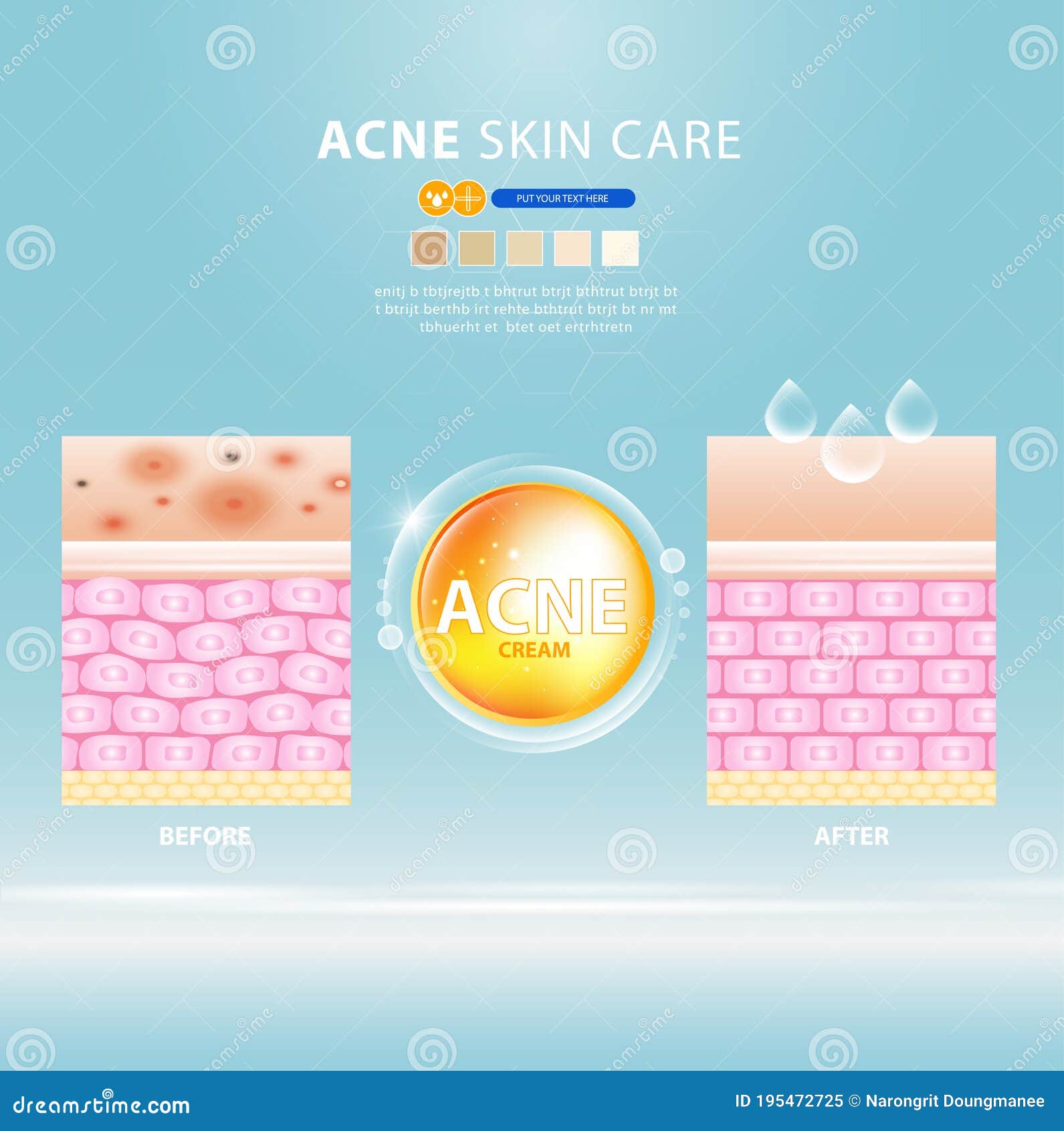Acne Skin Spot Pimple Problem Vector Design Stock Vector - Illustration ...