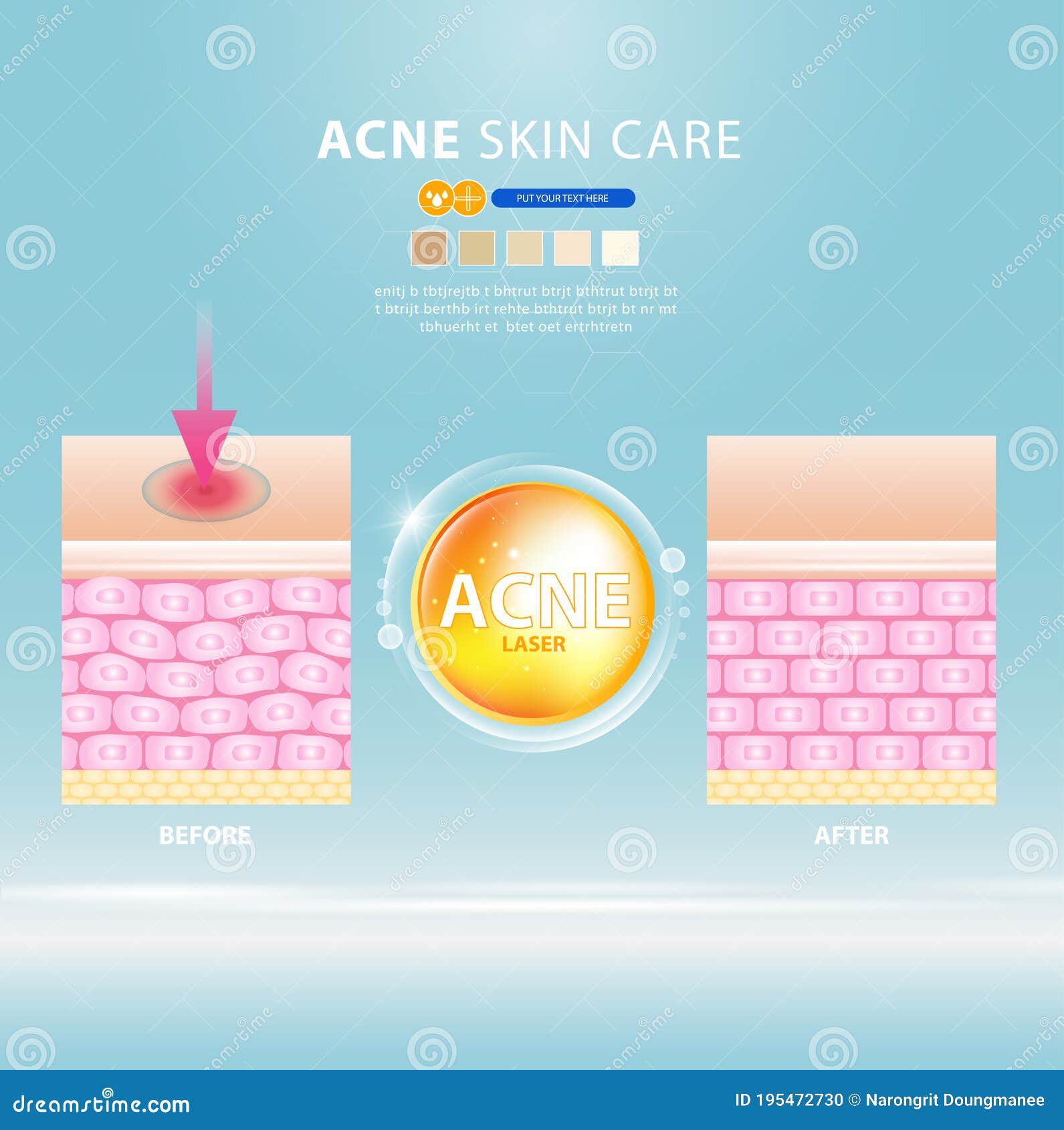 Acne Skin Spot Pimple Problem Vector Design Stock Vector - Illustration ...