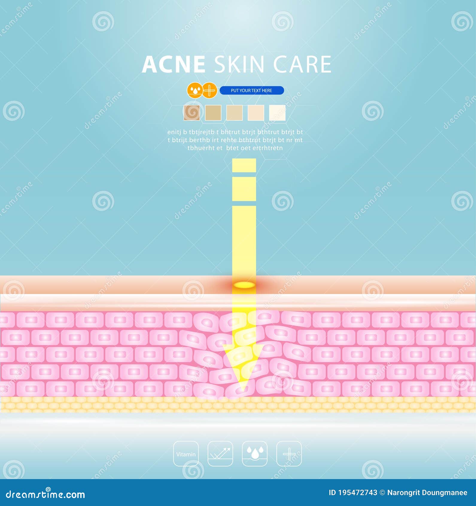 Acne Skin Spot Pimple Problem Vector Design Stock Vector - Illustration ...