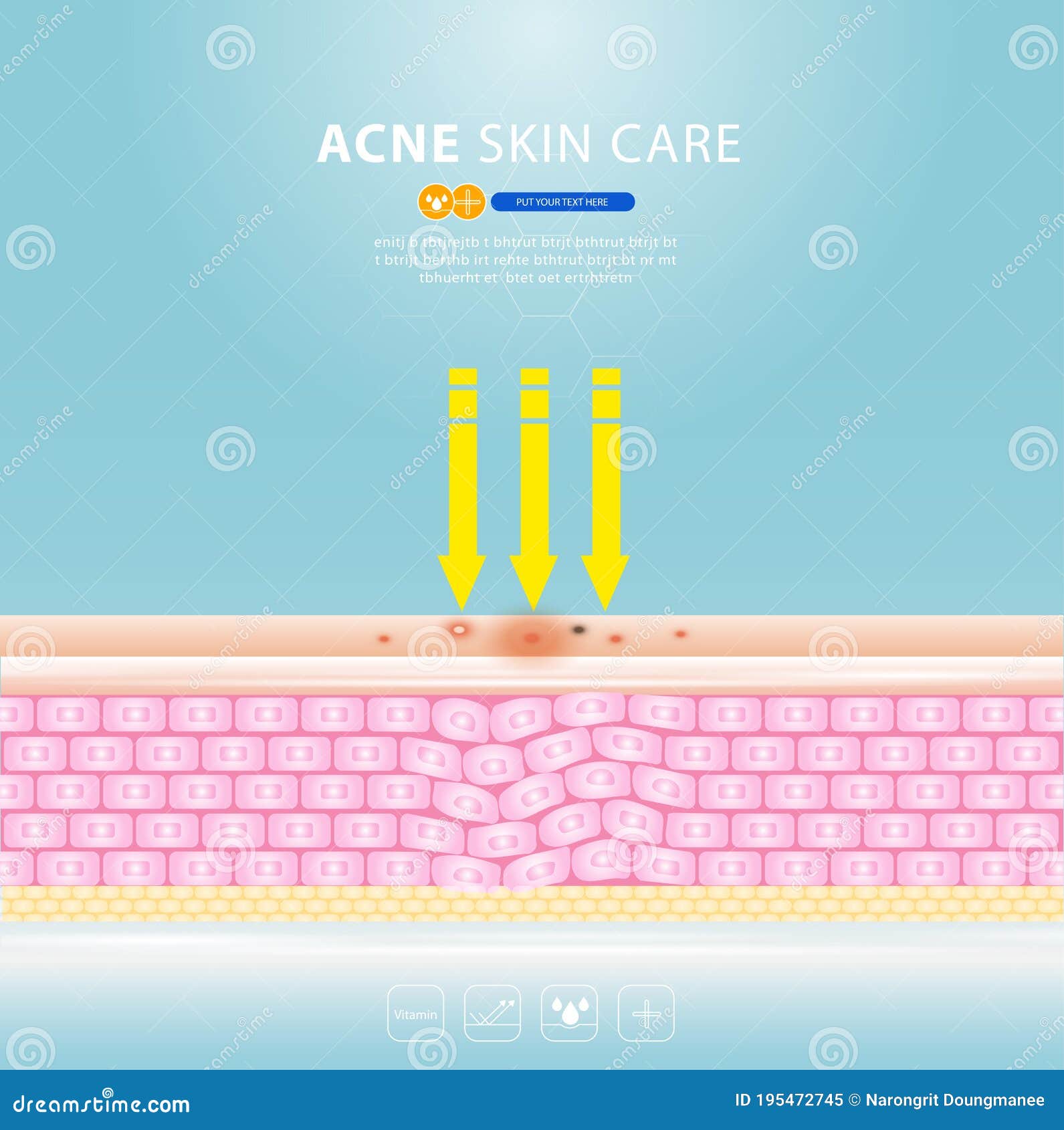Acne Skin Spot Pimple Problem Vector Design Stock Vector - Illustration ...