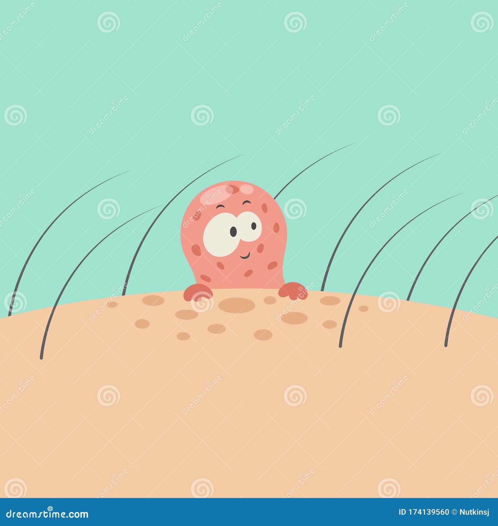 Acne on Skin Vector Cartoon Stock Vector - Illustration of skin ...