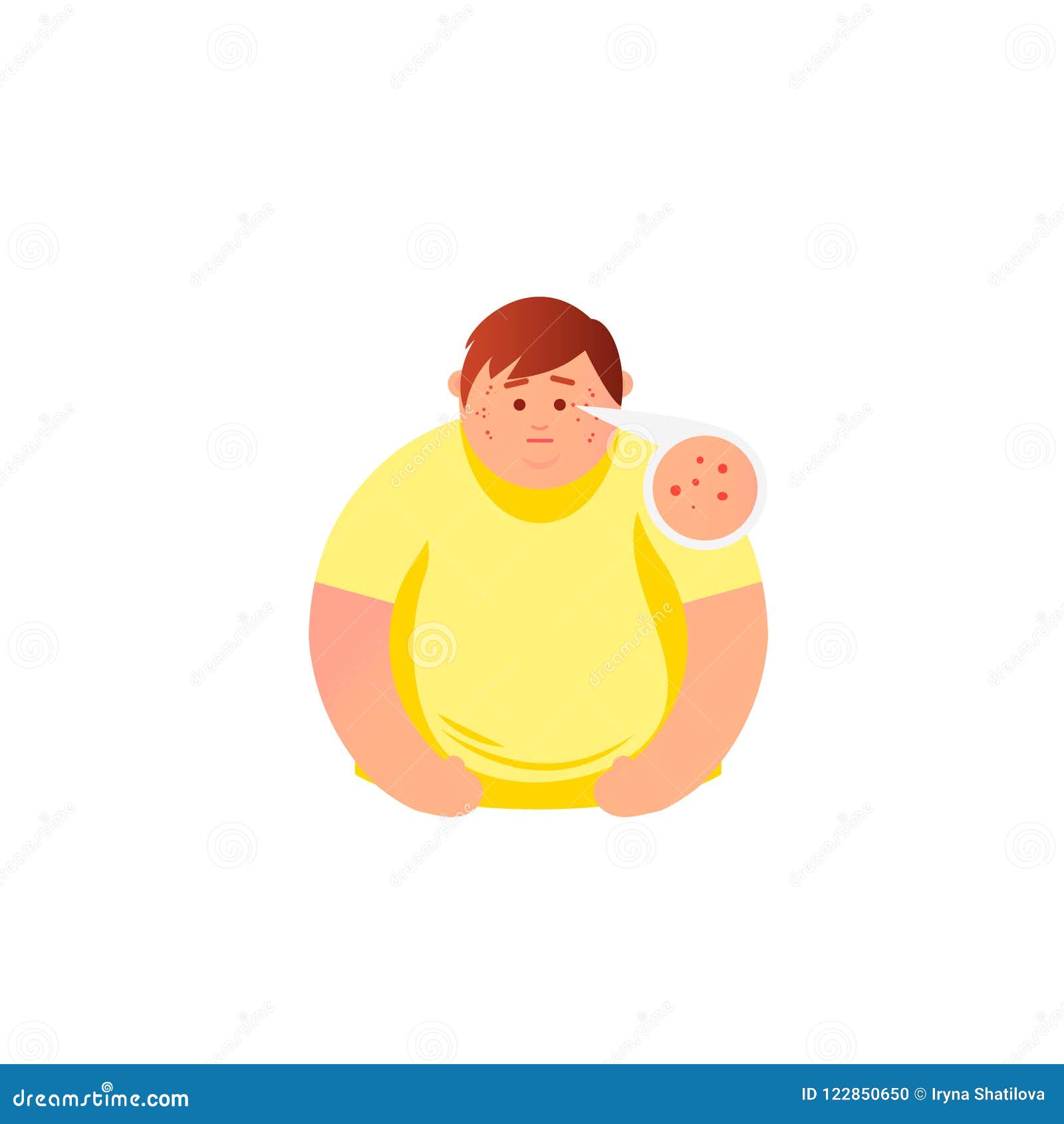 Acne Types Infographic Elements Vector Flat Illustration. Girl With ...