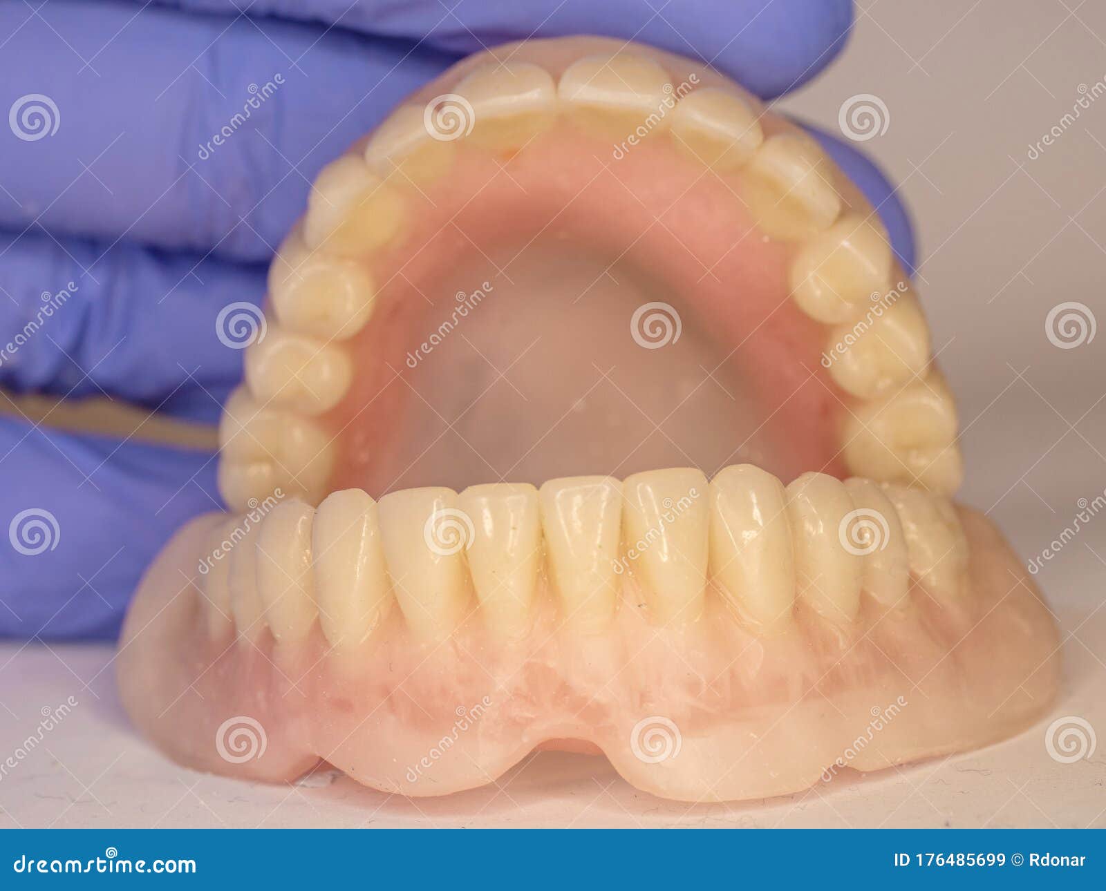 Acrylic Dental Prosthesis with Metal Retaining Base Stock Image - Image ...