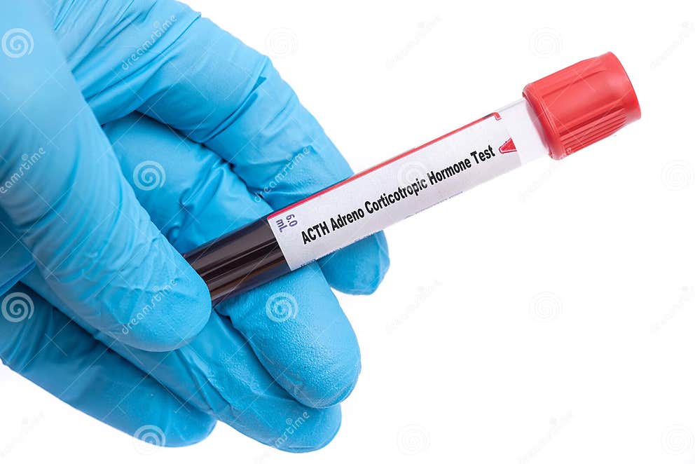 Acth Adreno Corticotropic Hormone Test Medical Check Up Test Tube With