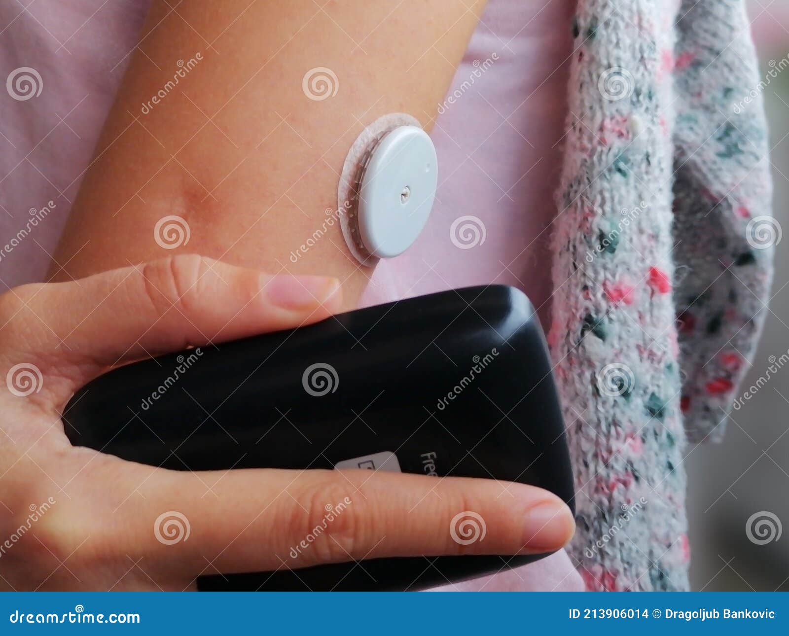 FreeStyle Libre Sensor On An Arm Royalty-Free Stock Image ...