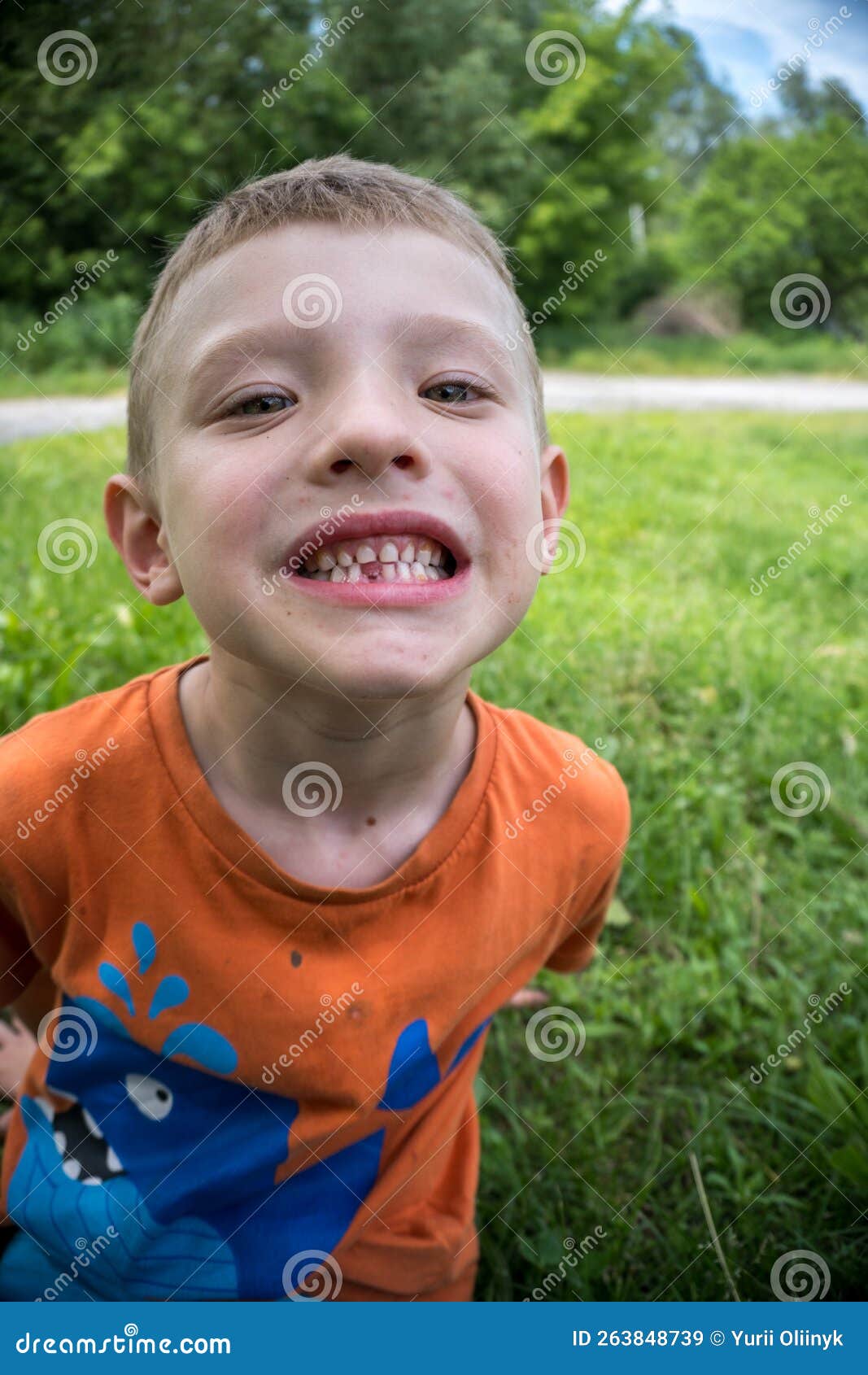 Small Child Lost the First Tooth Stock Image - Image of headphones ...