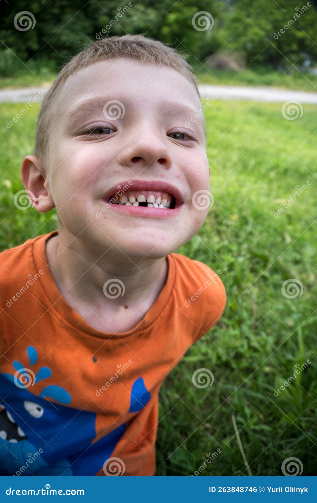 Small Child Lost the First Tooth Stock Photo - Image of glove, active ...