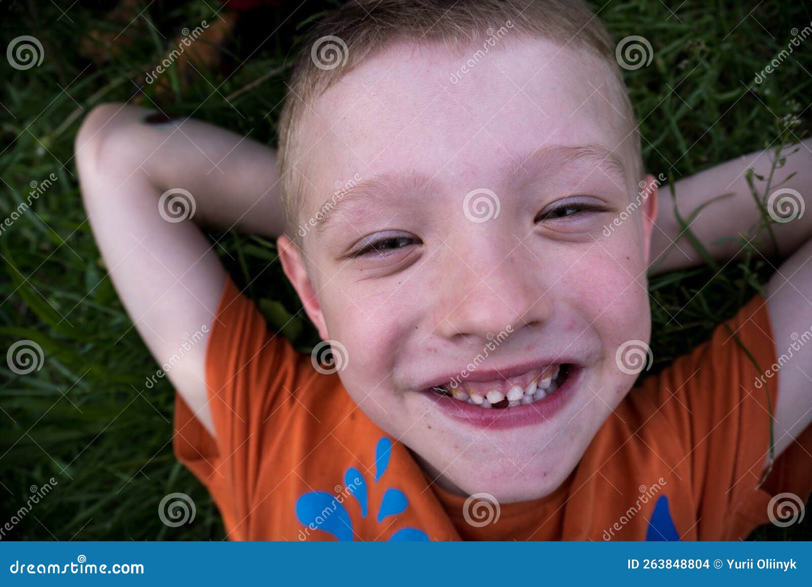 Small Child Lost the First Tooth Stock Photo - Image of childhood ...