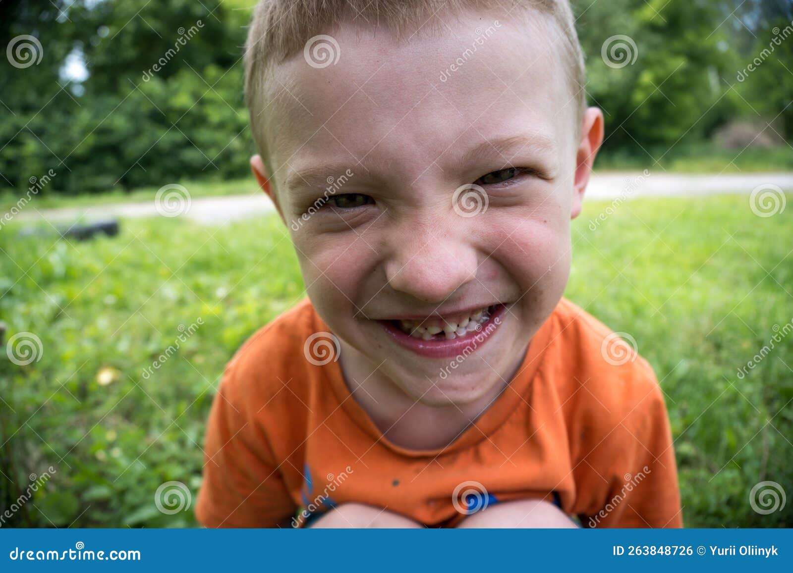Small Child Lost the First Tooth Stock Photo - Image of combat, hand ...
