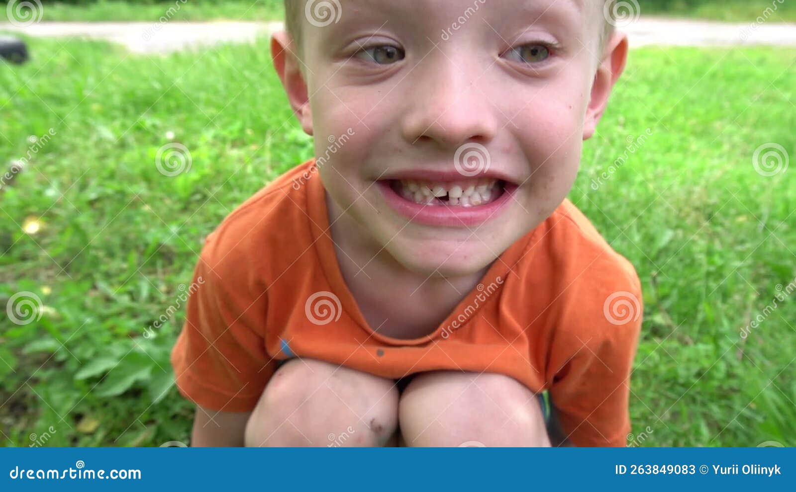 Small Child Lost the First Tooth Stock Video - Video of backyard, face ...