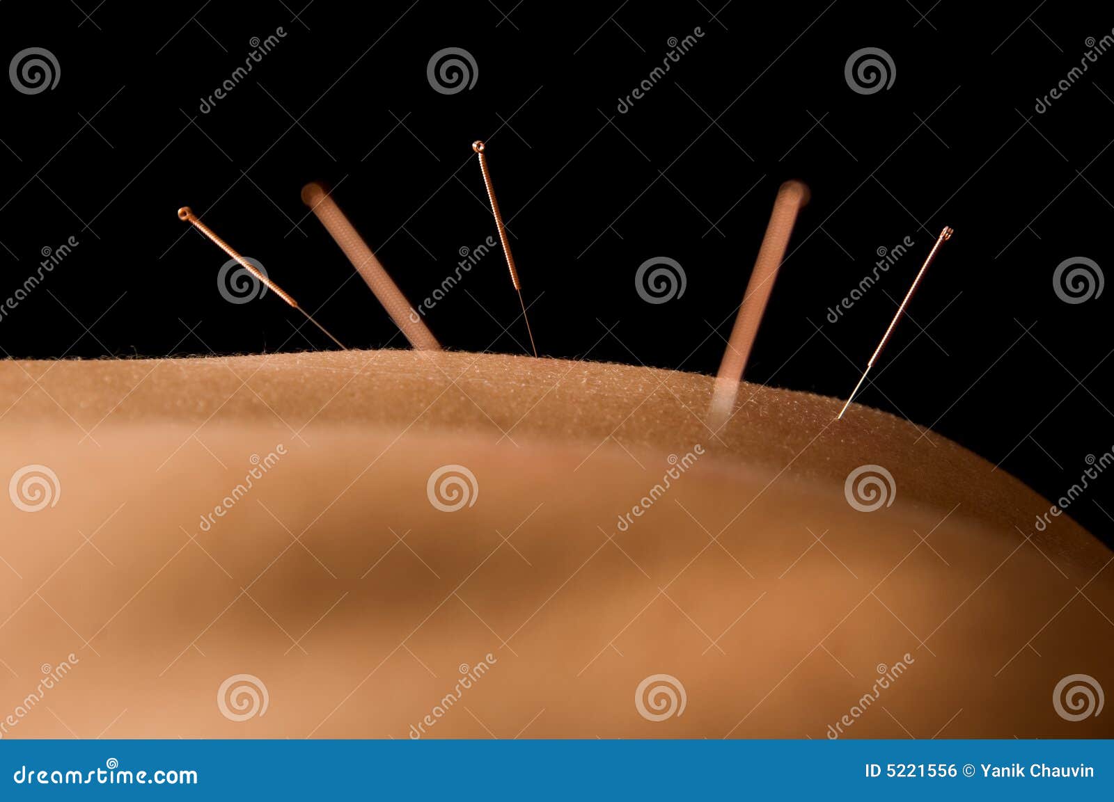 Acupuncture stock photo. Image of lifestyle, luxury, female - 5221556