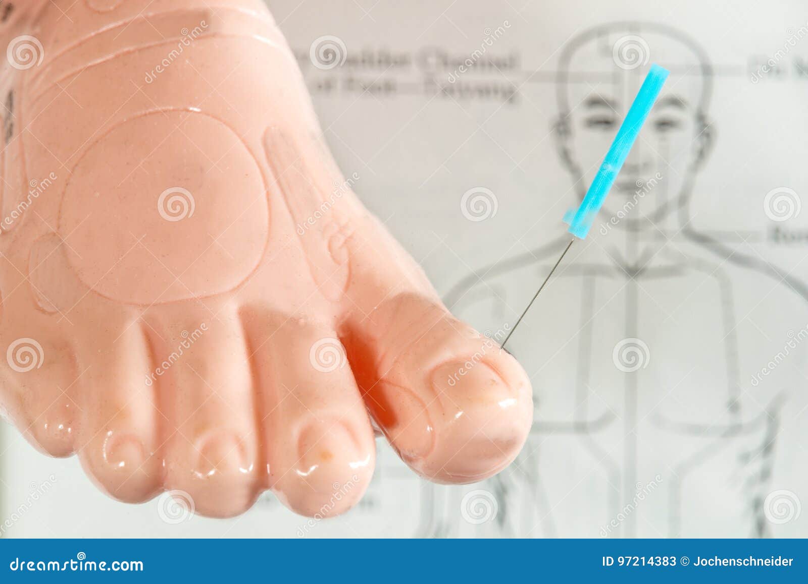 Acupuncture Demonstration On Model Royalty-Free Stock Photo ...