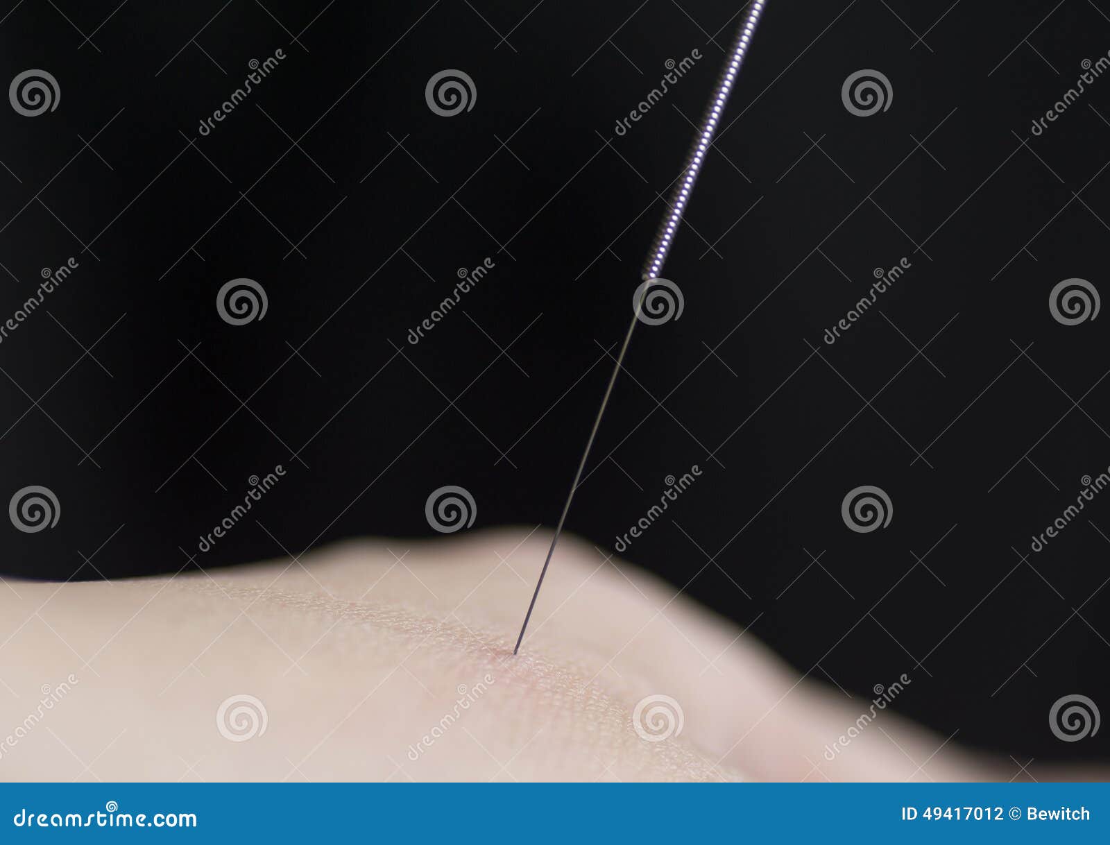 Acupuncture Needle with Black Background Stock Photo - Image of ...