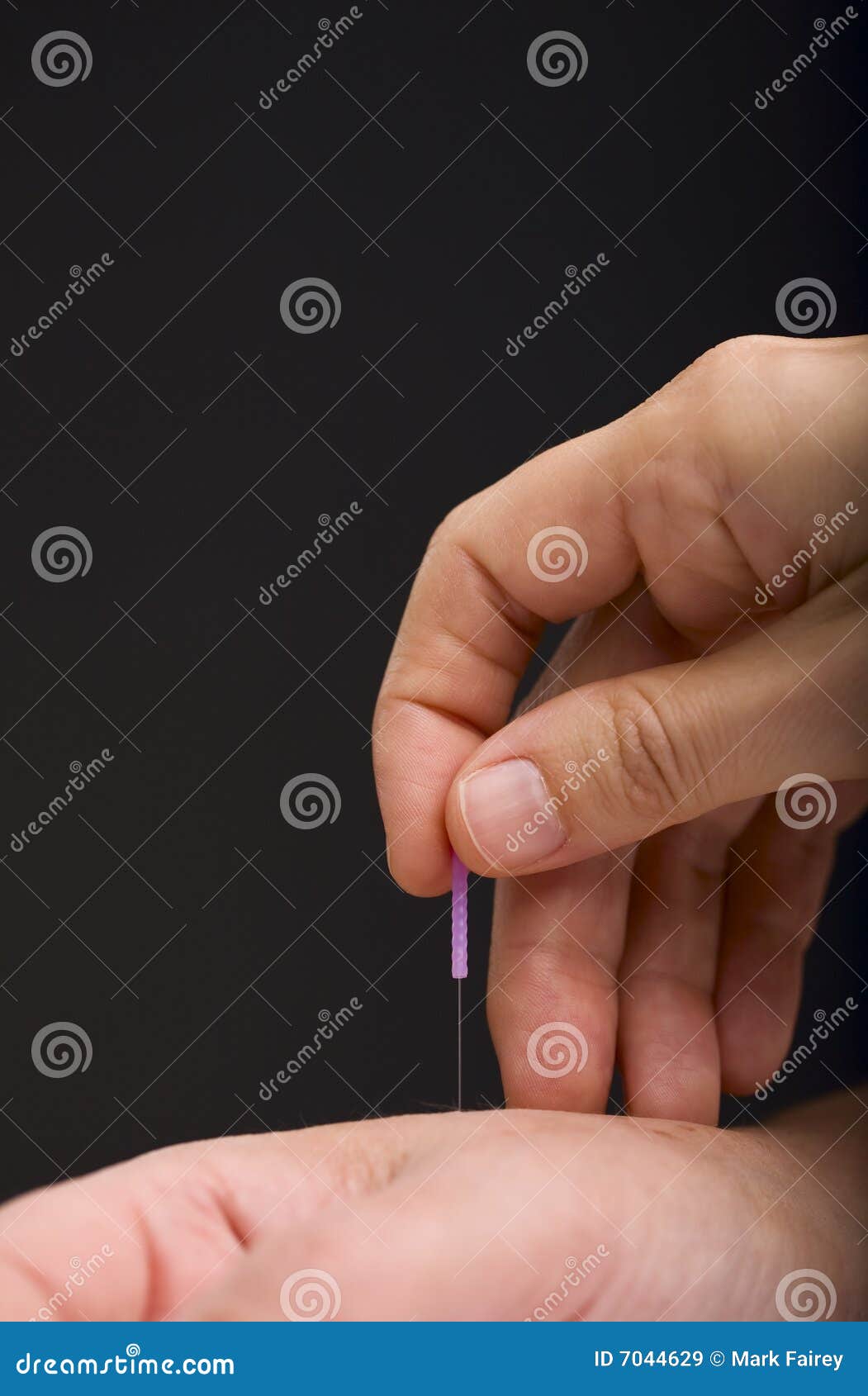 Acupuncture needle on hand stock image. Image of healing - 7044629