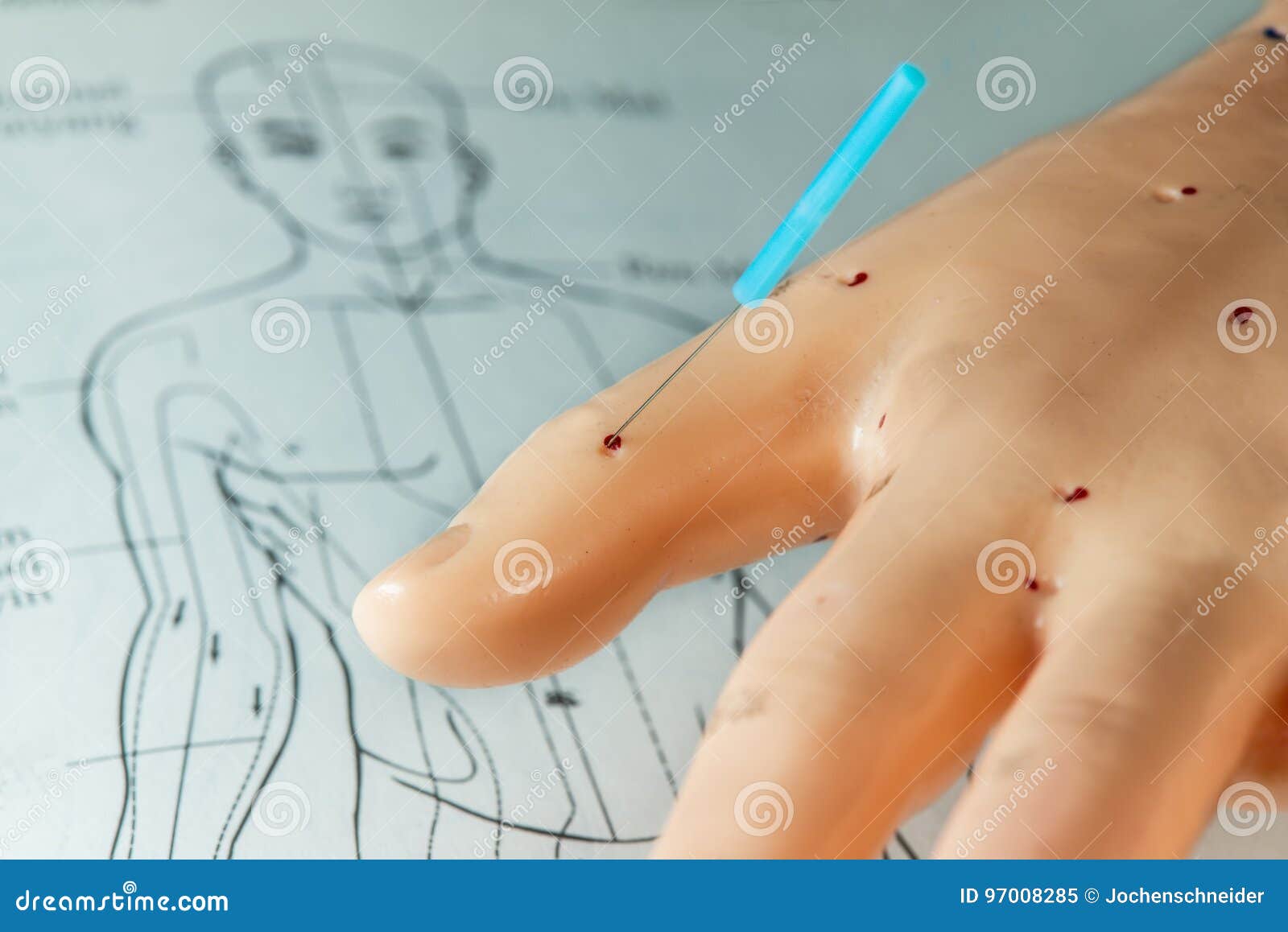 Acupuncture Needle on Hand Model Stock Image - Image of cure, care ...