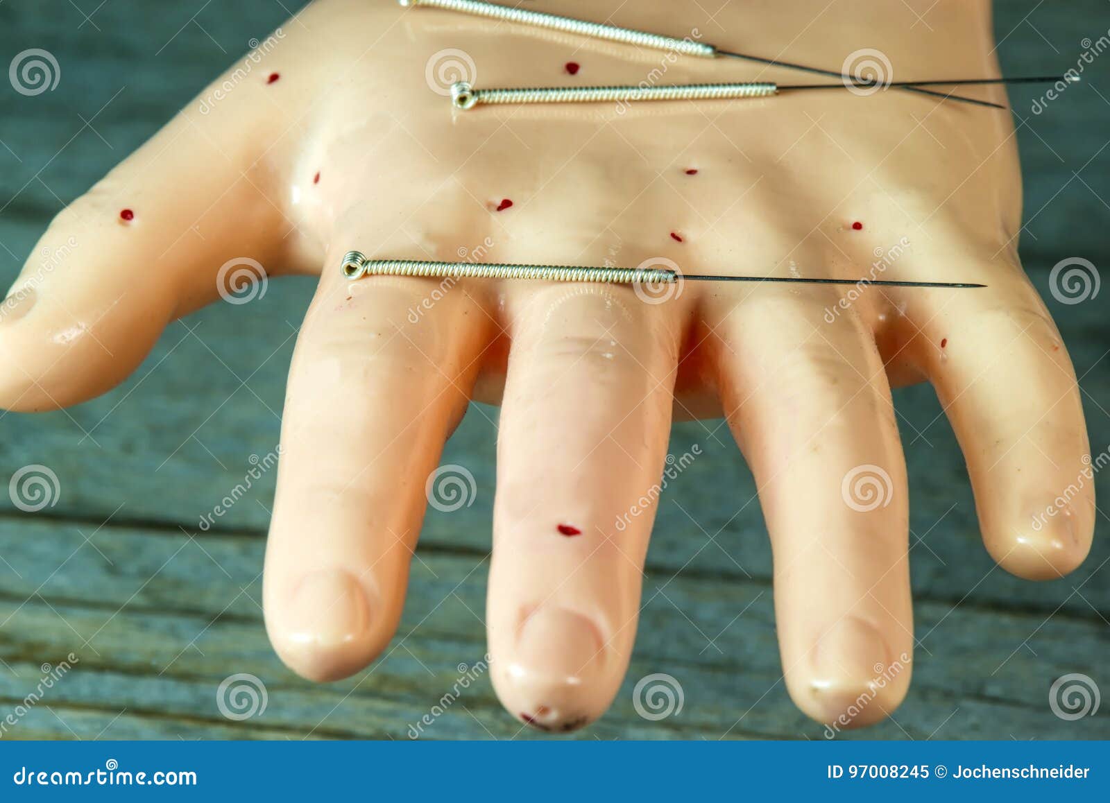 Acupuncture Needles on Hand Model Stock Image - Image of tool, hand ...