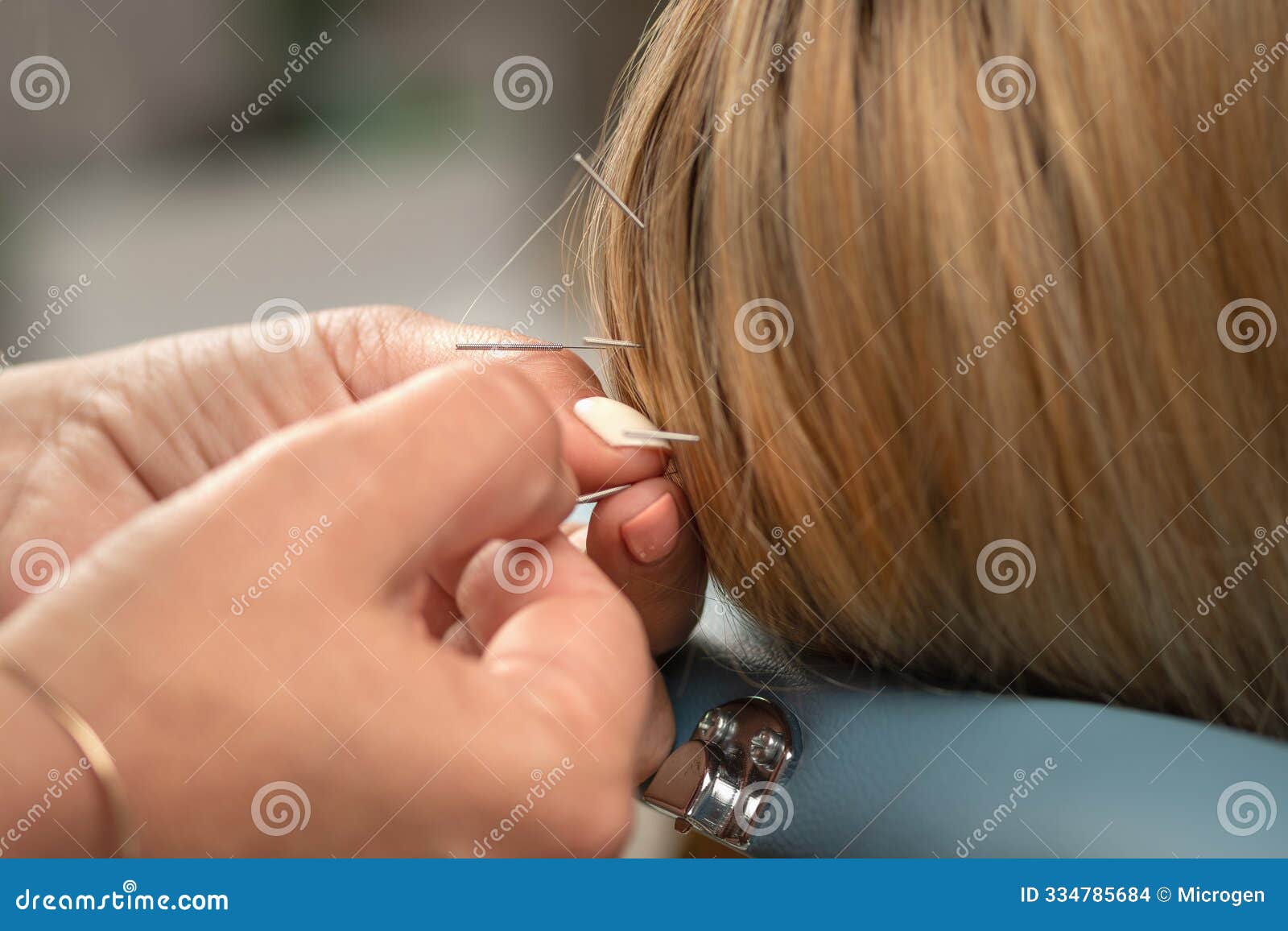 Acupuncture Therapist Applying Needles into the Scalp Surface To ...