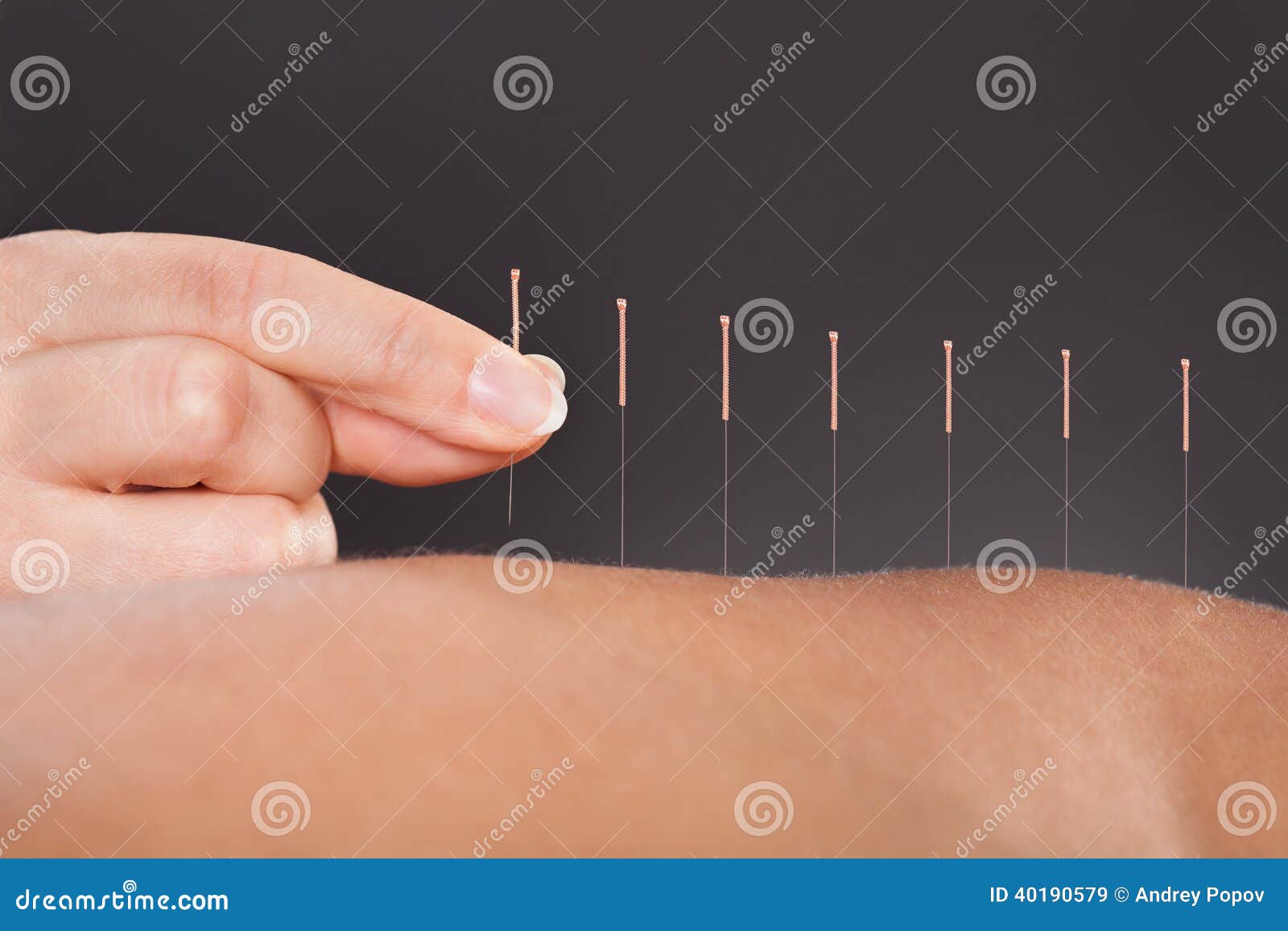Acupuncture treatment stock image. Image of lifestyle - 40190579 Acupuncture treatment stock image. Image of lifestyle - 40190579