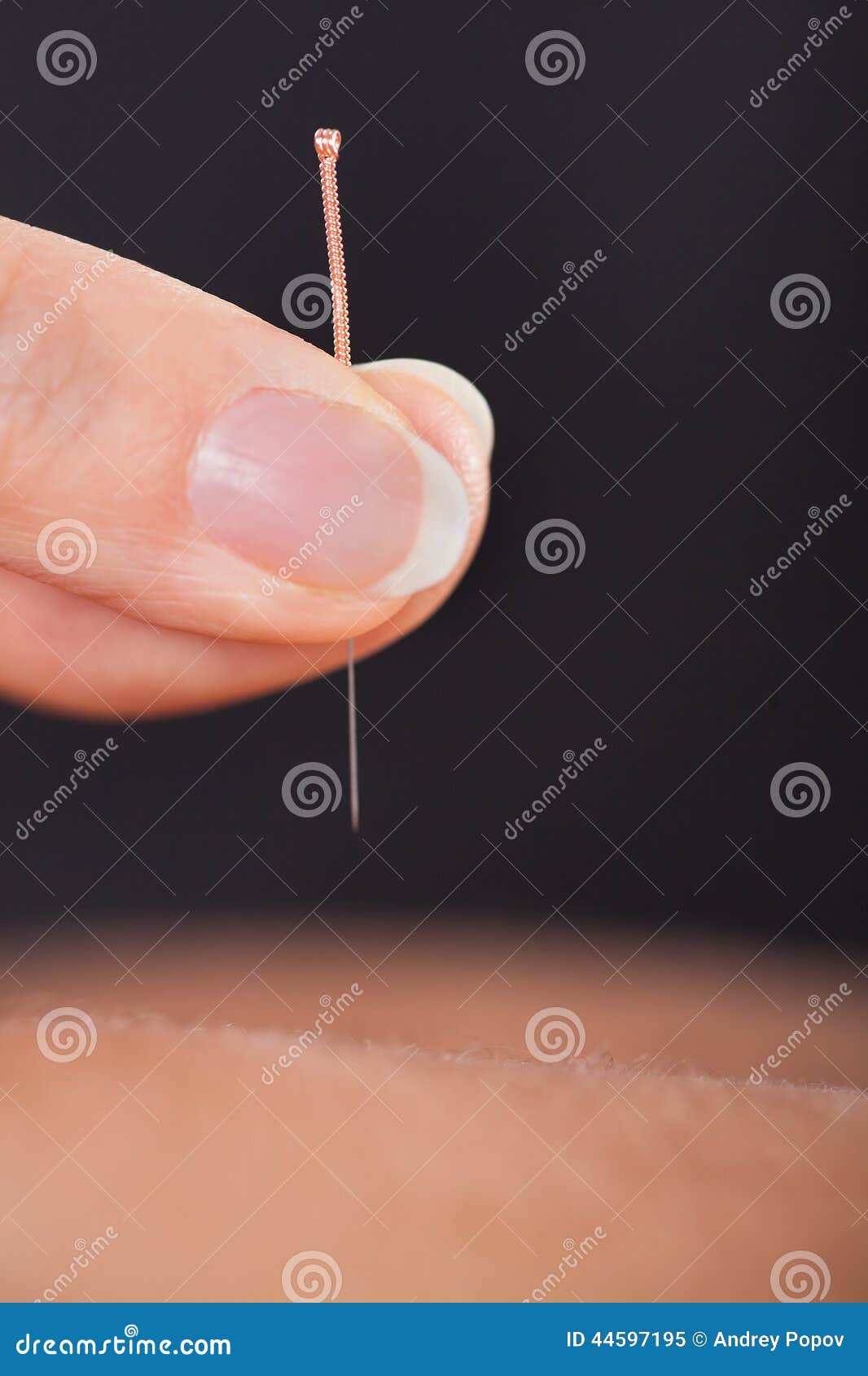 Acupuncture treatment stock image. Image of physio, hand - 44597195