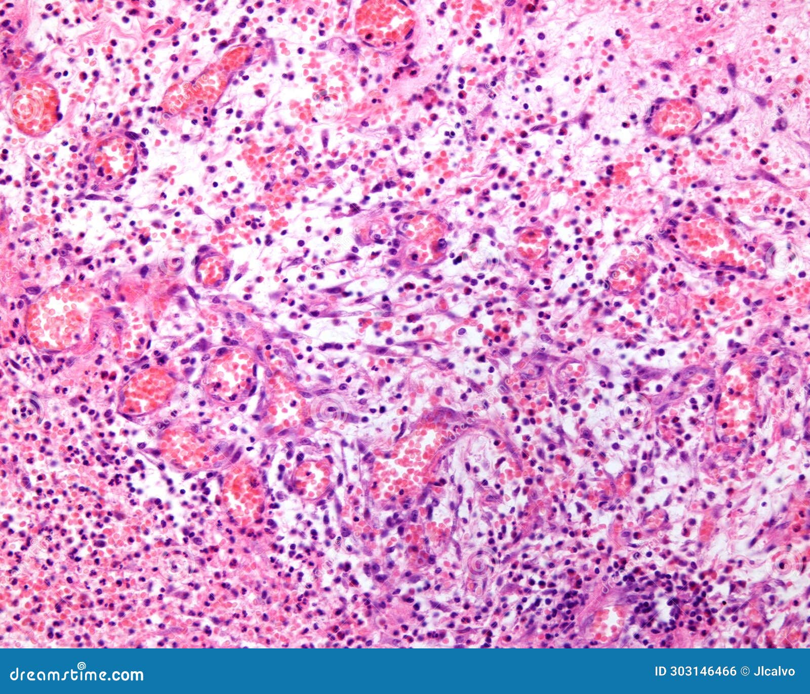 Vascular Connective Tissue