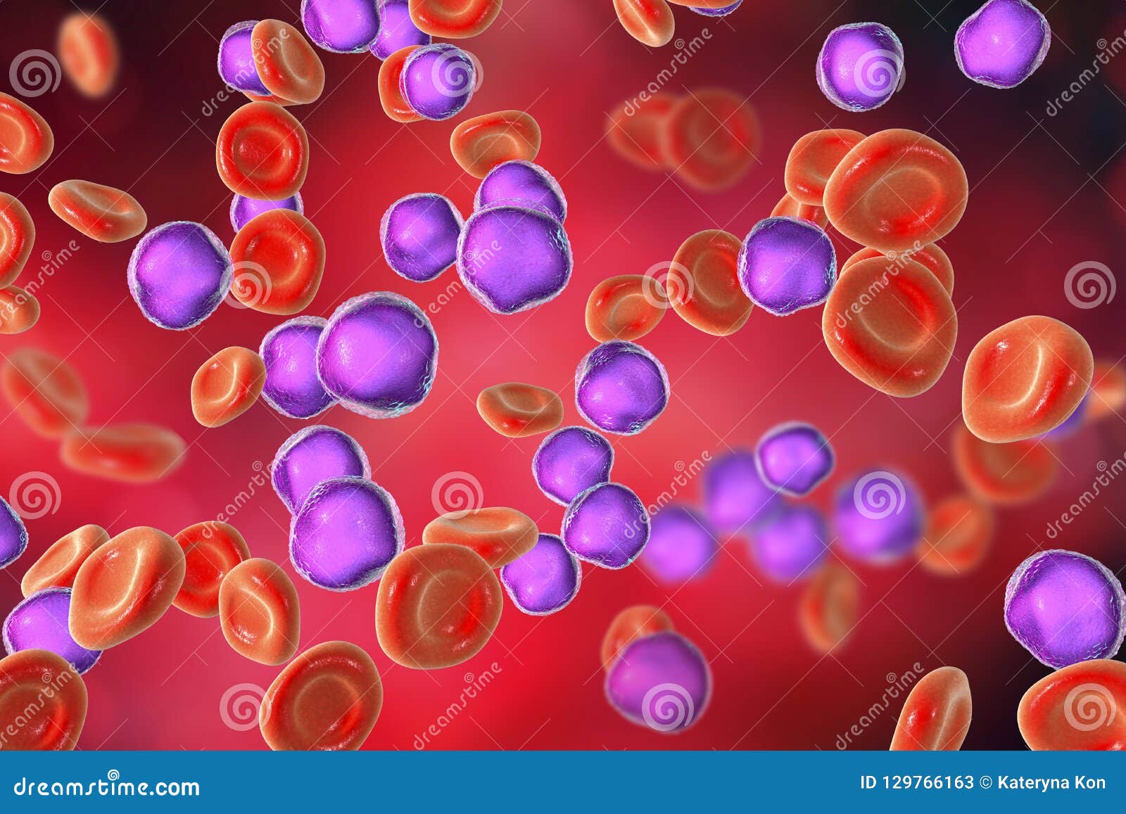 Acute Lymphoblastic Leukemia Royalty-Free Illustration | CartoonDealer ...