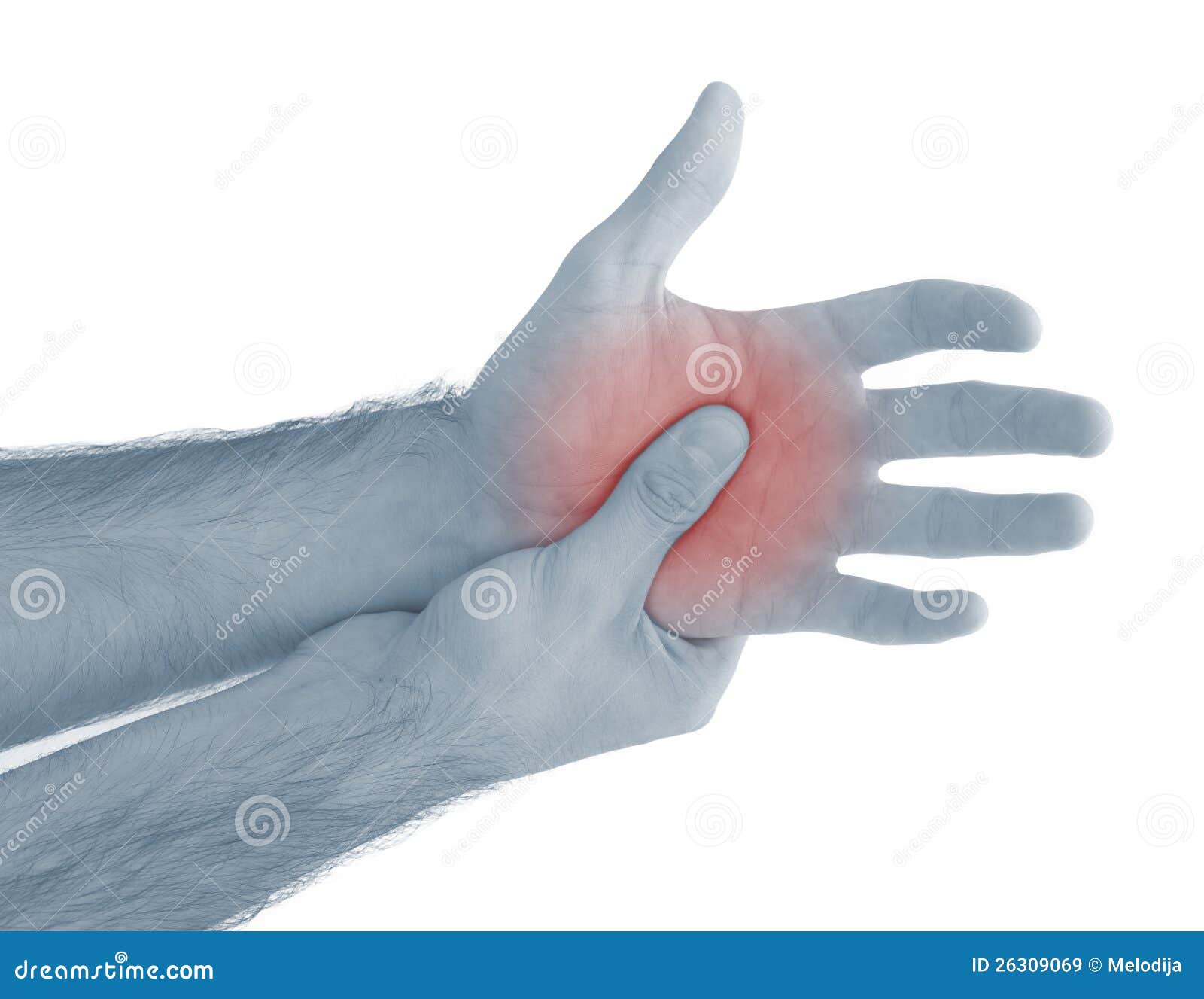 Acute pain in a man palm. stock image. Image of joint - 26309069
