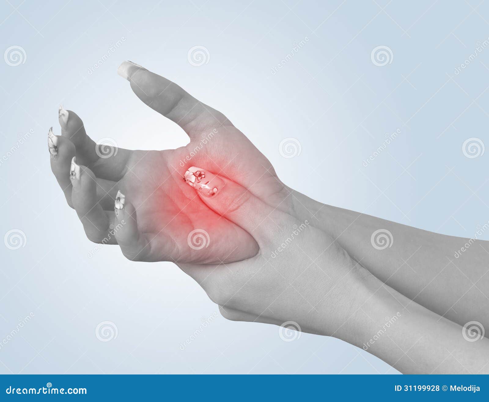 Acute pain in a woman palm stock photo. Image of massaging - 31199928