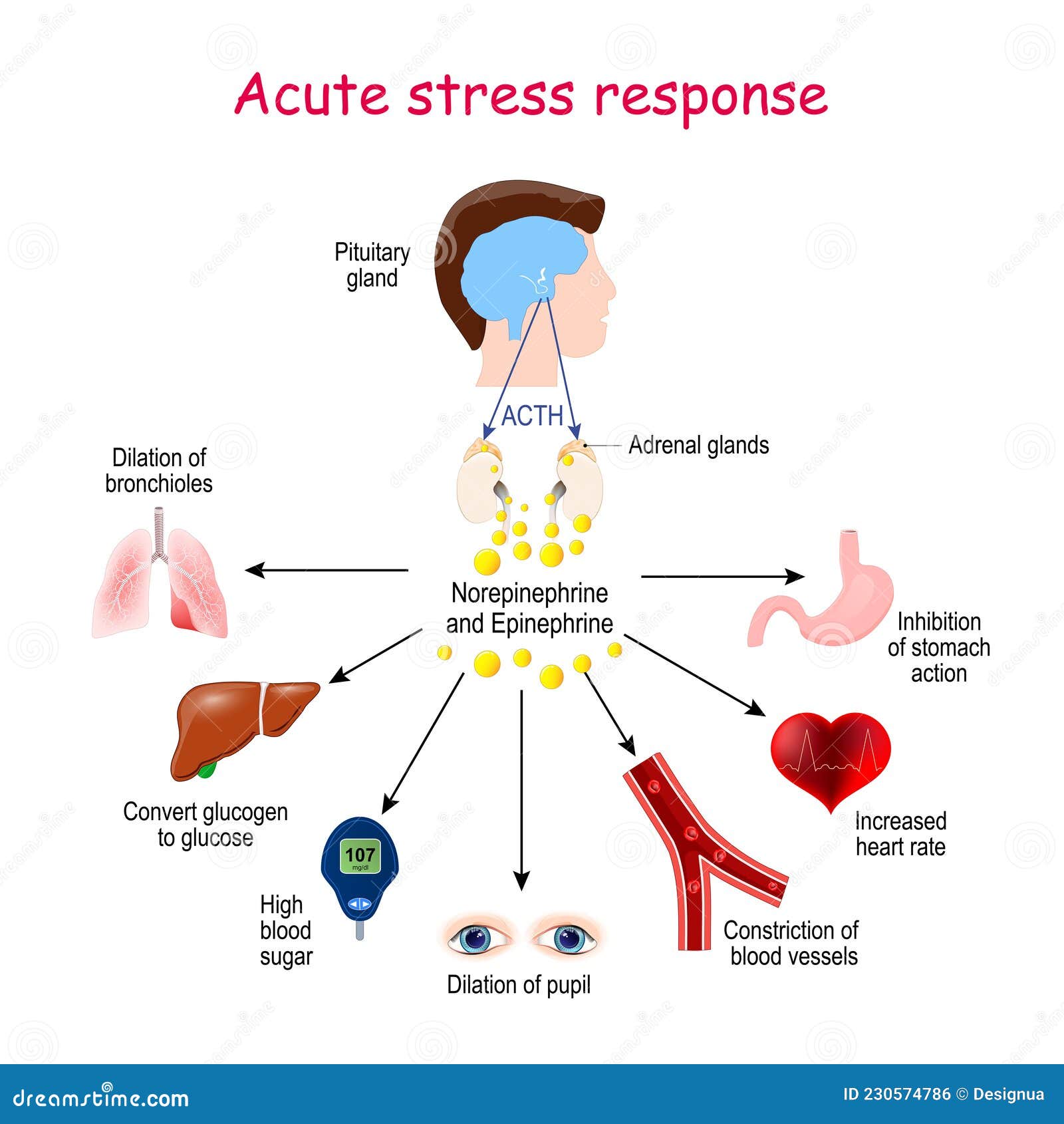 Acute Stress Response. Reaction of Endocrine System Stock Vector ... Acute Stress Response. Reaction of Endocrine System Stock Vector ...