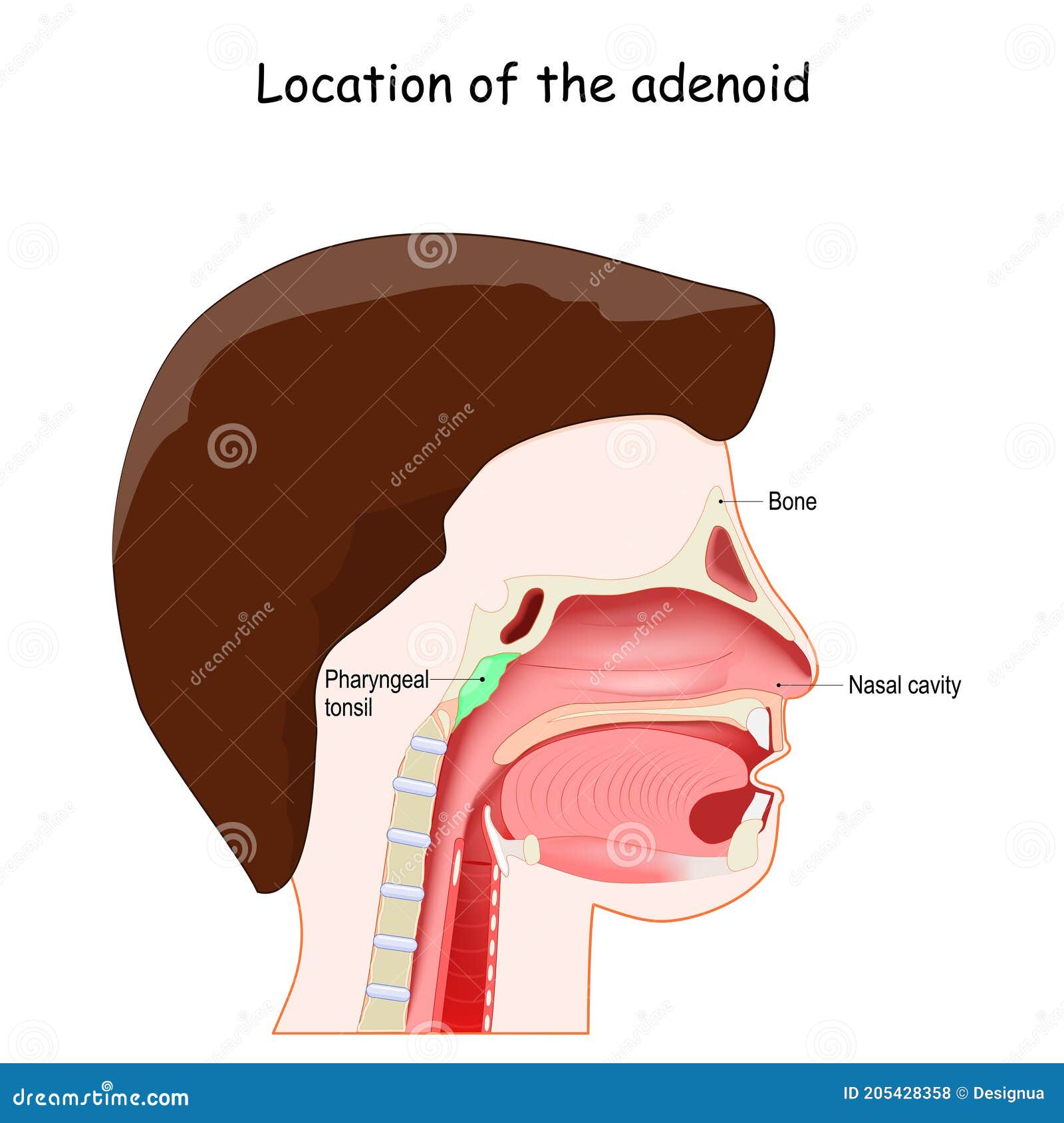 Enlarged Adenoid Glands Cartoon Vector | CartoonDealer.com #46045793 Enlarged Adenoid Glands Cartoon Vector | CartoonDealer.com #46045793