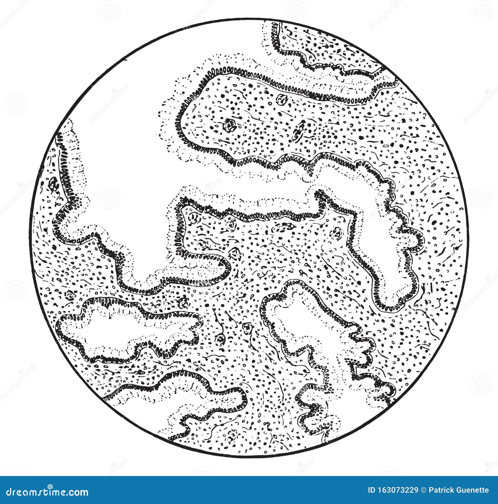 Pathology Of Cervix Icon Color Illustration Cartoon Vector ...