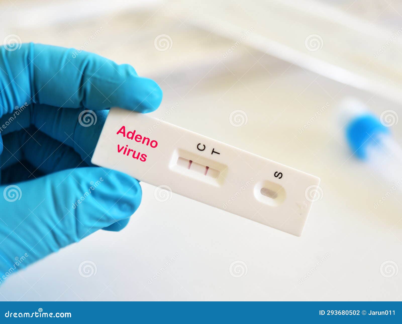 Adenovirus Positive Test Result Stock Photo - Image of coronavirus ...