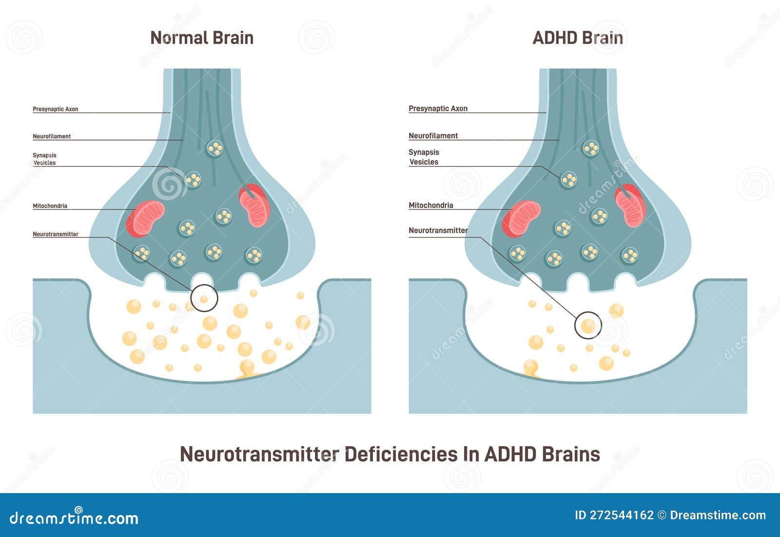 ADHD Brain Concept. Attention Deficit Hyperactivity Disorder ... ADHD Brain Concept. Attention Deficit Hyperactivity Disorder ...