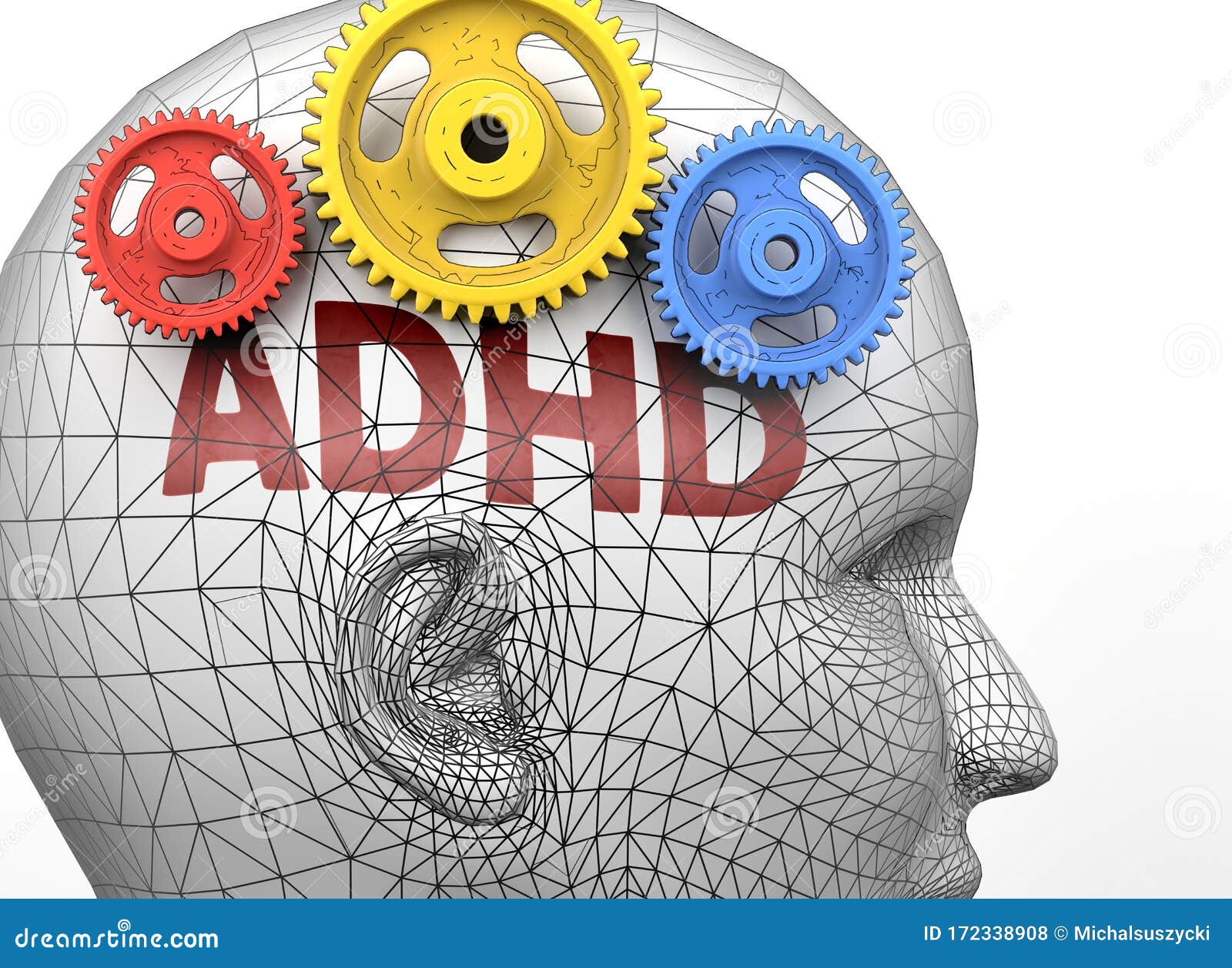 Adhd and Human Mind - Pictured As Word Adhd Inside a Head To Symbolize ...