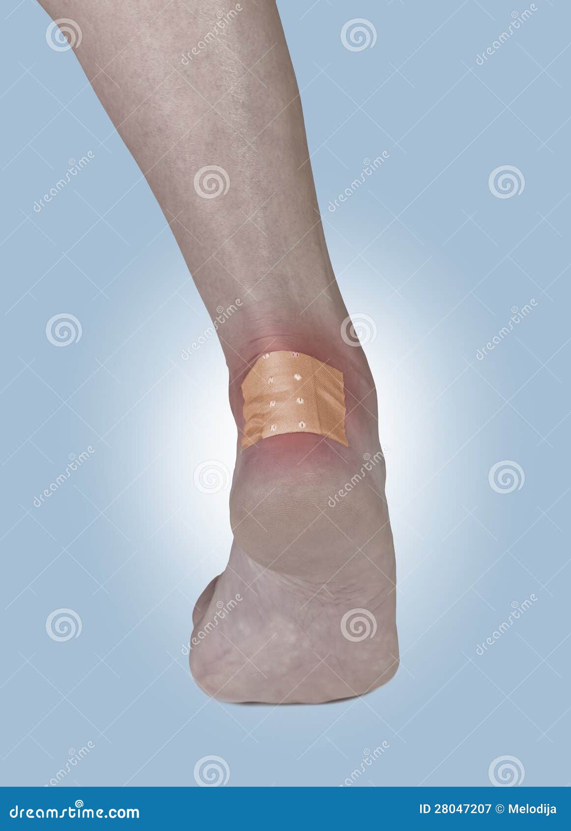 Adhesive Healing Plaster on the Heel. Stock Image - Image of hurt ...