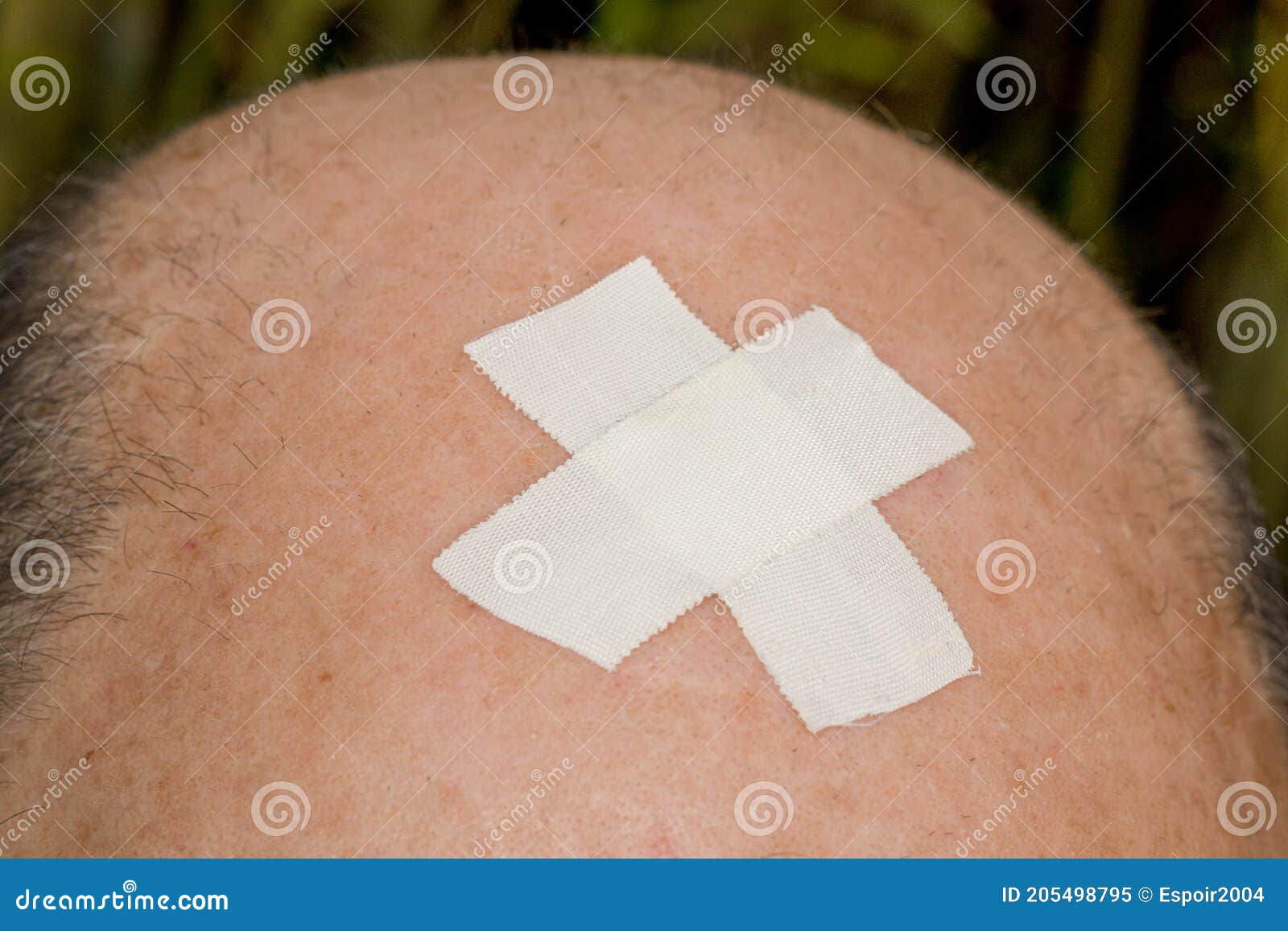 Adhesive patch on forehead stock image. Image of plaster - 205498795