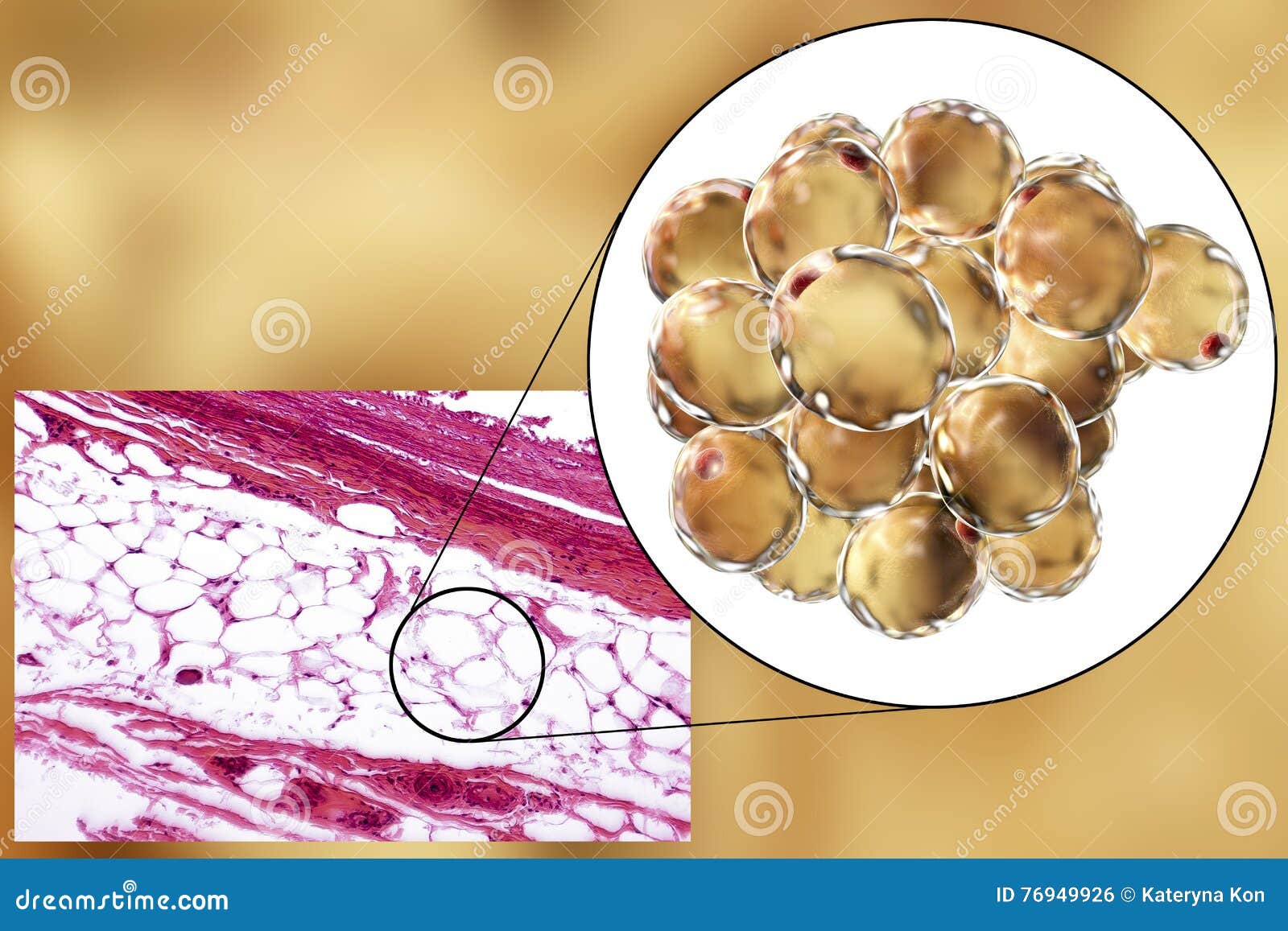 Adipocytes, Micrographe Et Illustration 3D Photo stock - Image du ...