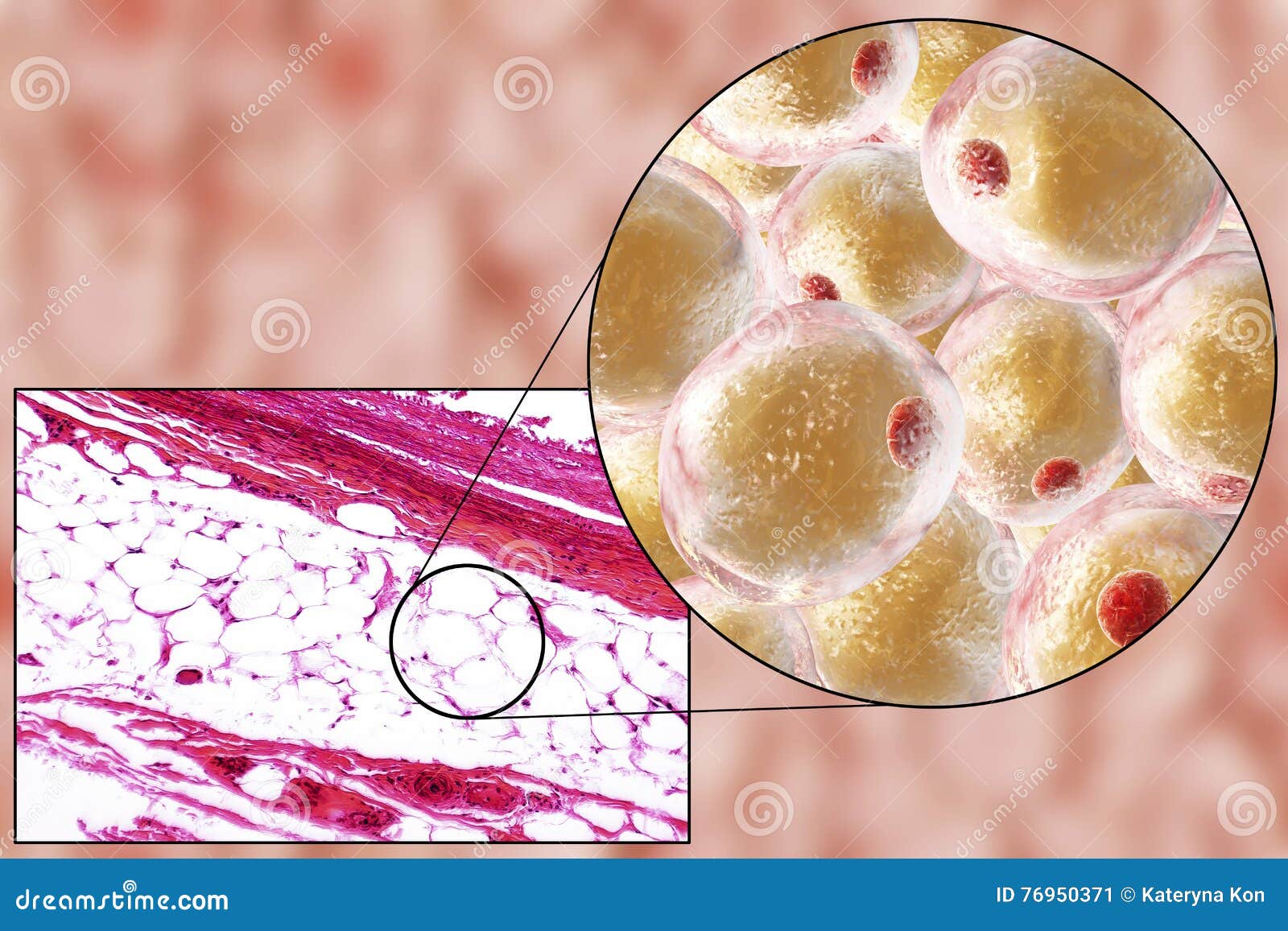 Adipocytes, Micrographe Et Illustration 3D Image stock - Image du gros ...