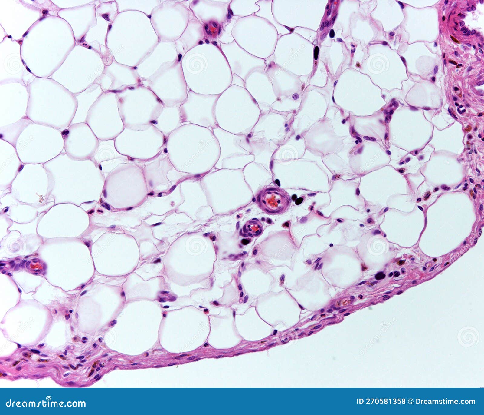 Adipose Tissue With Adipocytes
