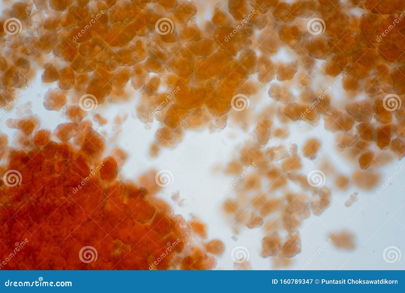 Adipose Tissue Under Microscope View Show Contains Large Lipid Droplet ...