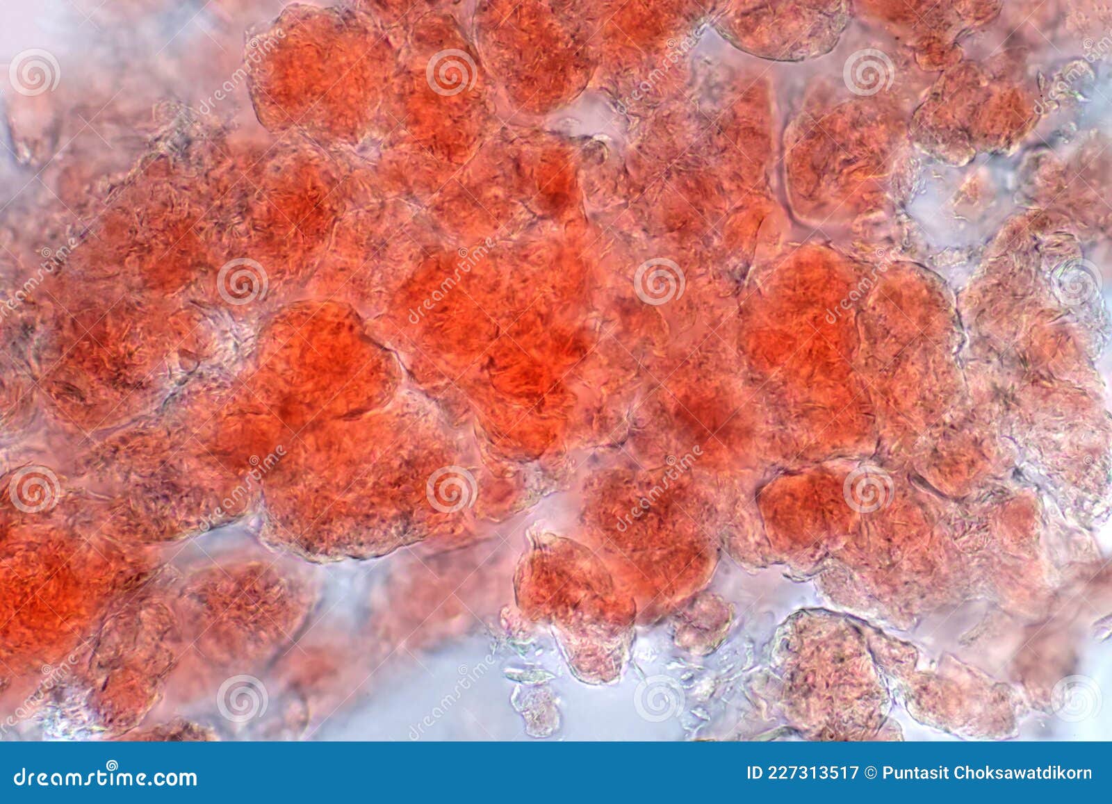 Adipose Tissue/Body Fat/Simply Fat Is A Loose Connective Tissue Under ...