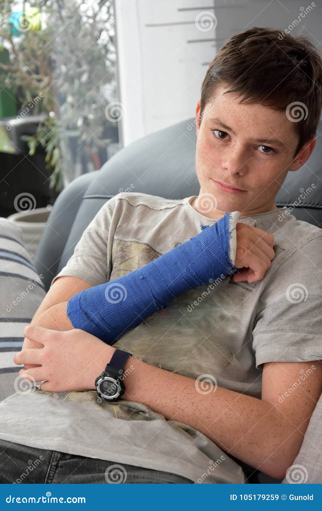 Adolescente Con Il Braccio Destro in Gesso Immagine Stock - Immagine di ...