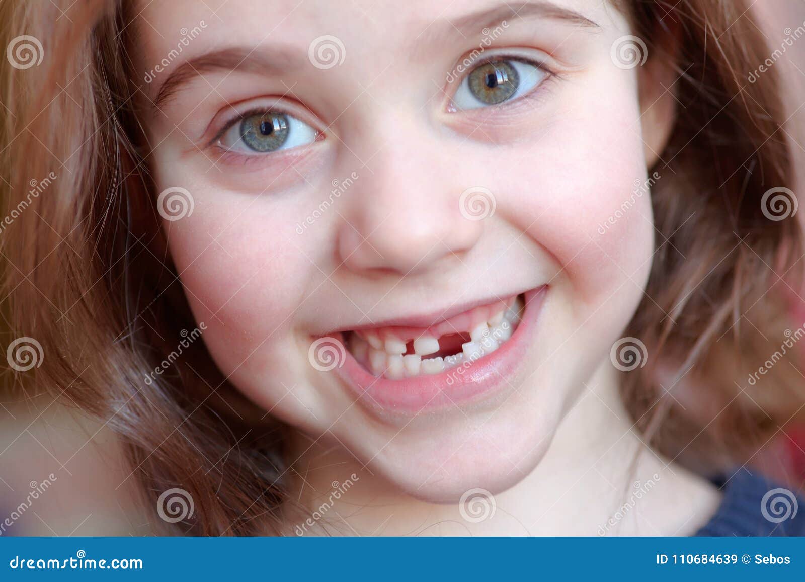 The Adorable Girl Smiles with the Fall of the First Baby Teeth. Stock ...