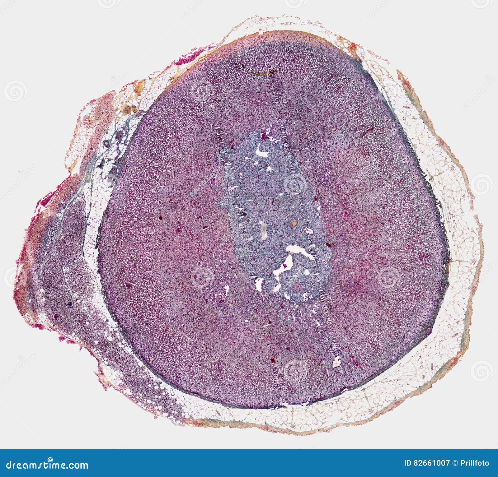 Adrenal Gland Cross Section Stock Image - Image of diagnosis, detail ... Adrenal Gland Cross Section Stock Image - Image of diagnosis, detail ...