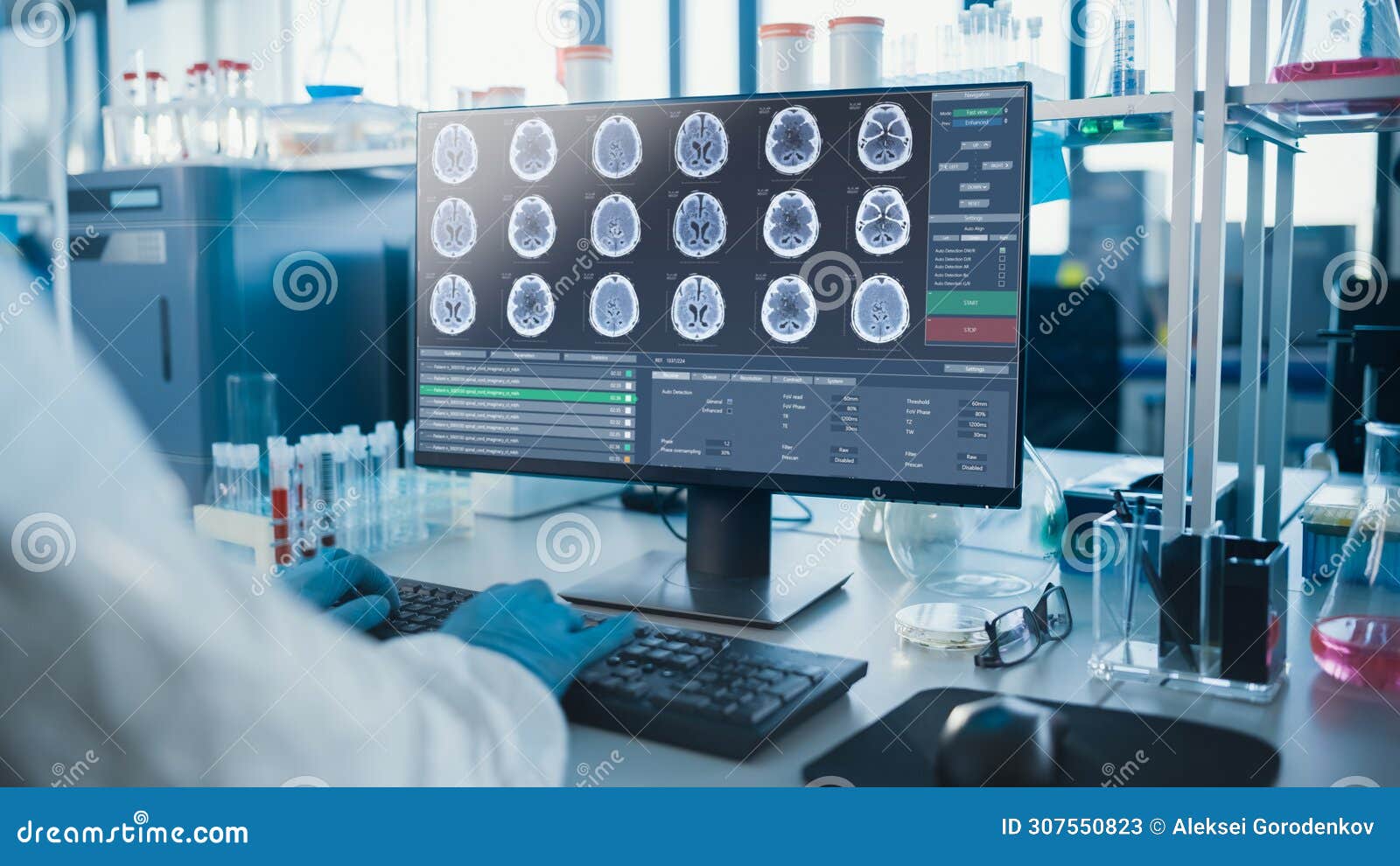 Neurology Scientist Examining Brain Nervous System Scan On On Monitor ...