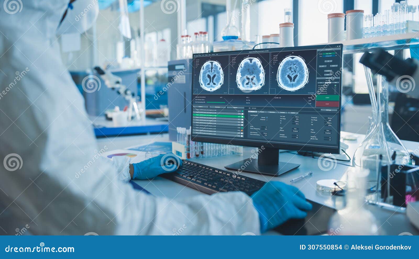 Neurology Scientist Examining Brain Nervous System Scan On On Monitor ...