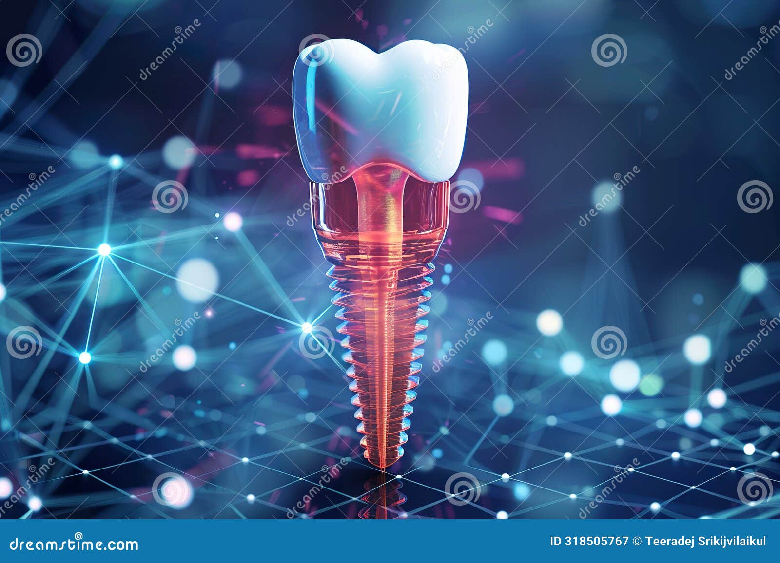 Advanced Dental Implant Technology. Generative AI Stock Illustration ... Advanced Dental Implant Technology. Generative AI Stock Illustration ...