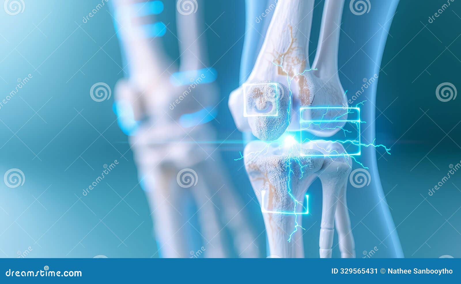 Advanced Knee Joint Technology and Diagnostics Stock Illustration ...