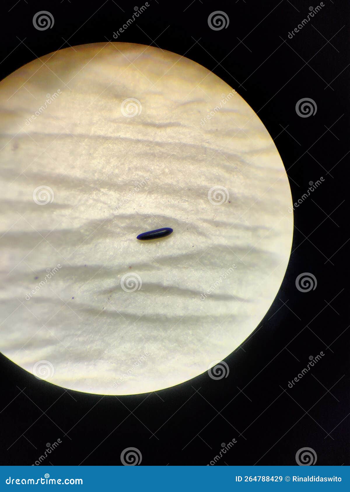 Aedes Aegypti Egss Under Microscope Stock Image - Image of circle ...